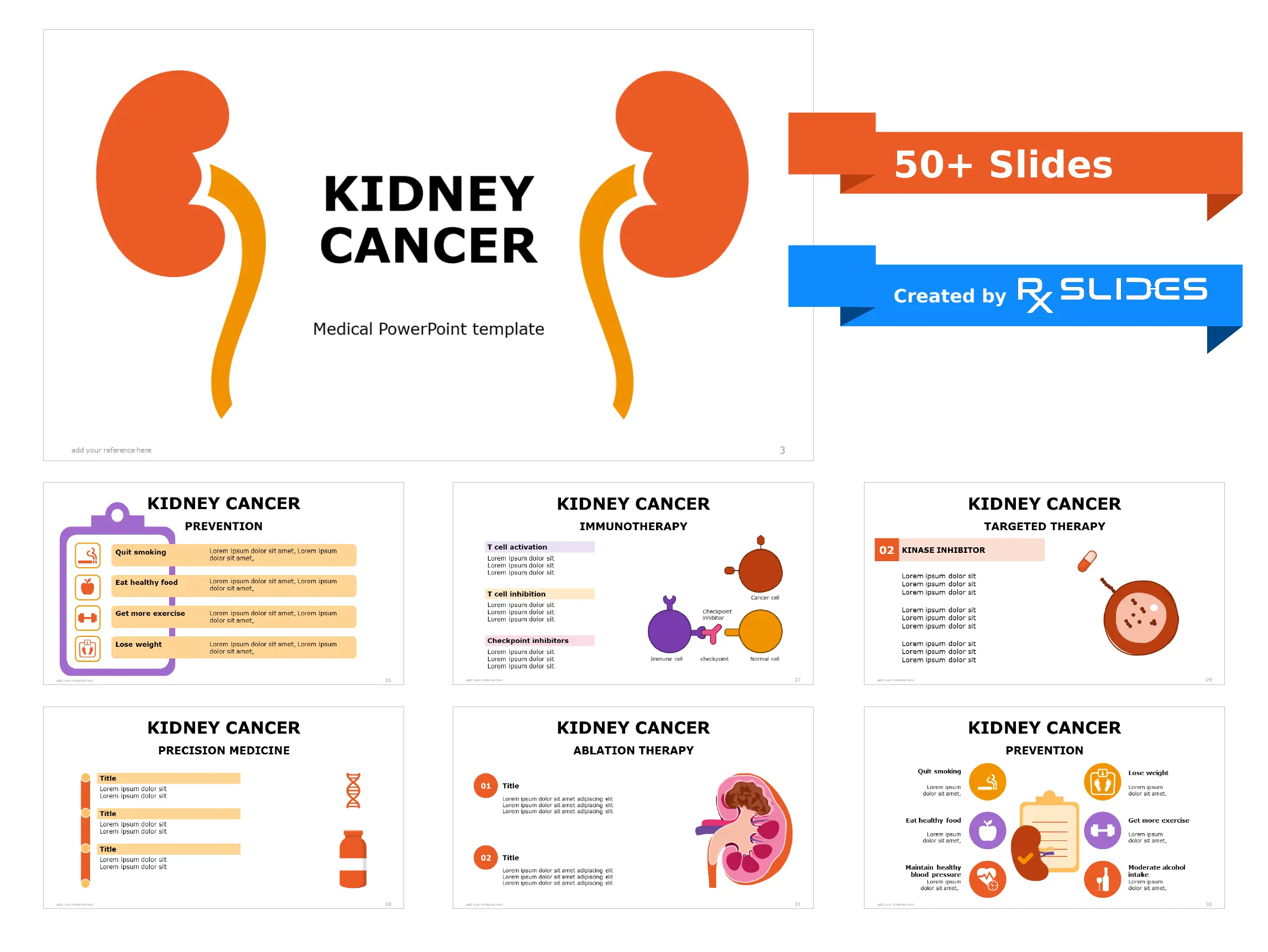 Download Kidney Cancer PowerPoint Template| RxSlides