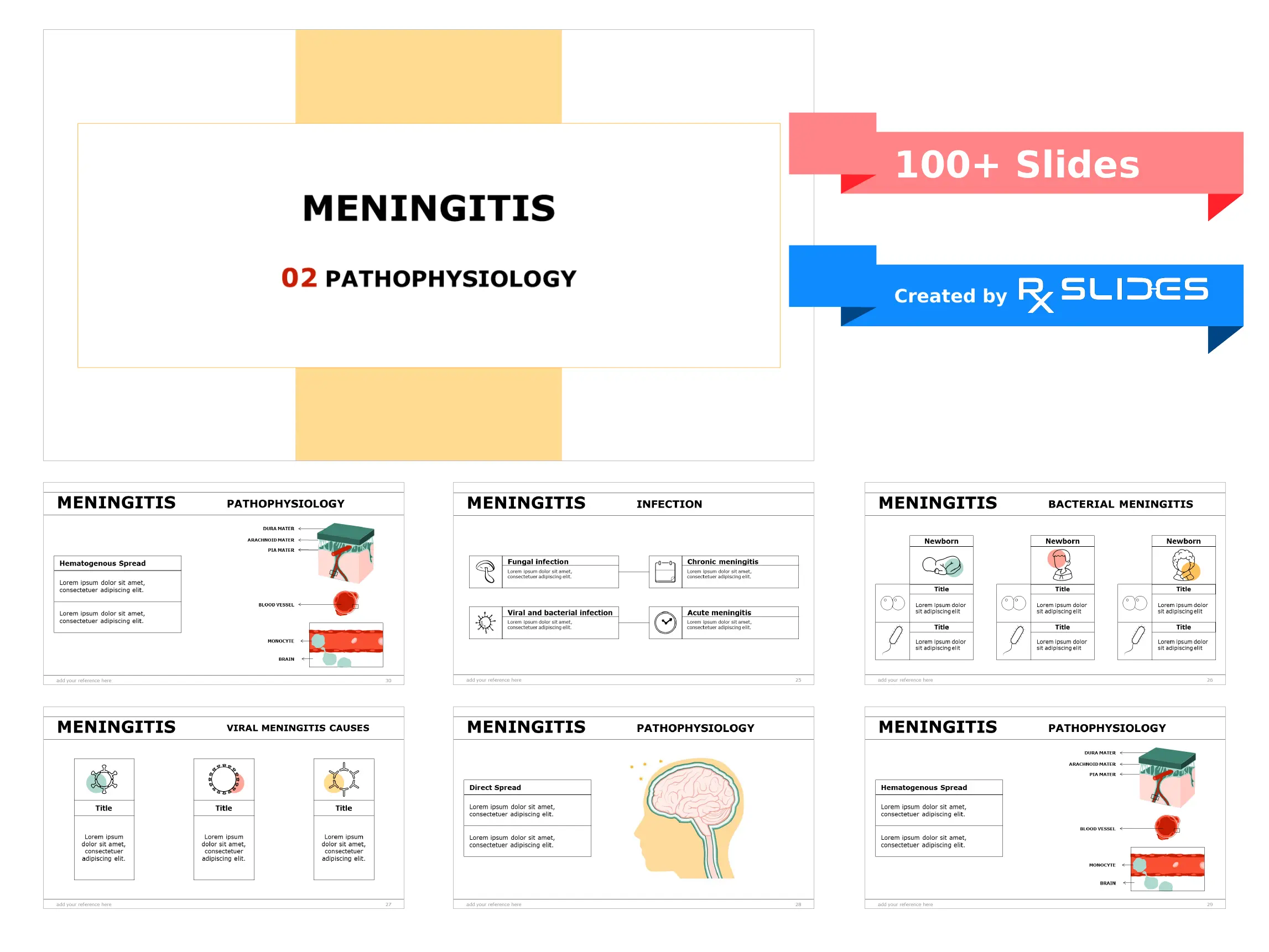 Download Meningitis PowerPoint Template| RxSlides
