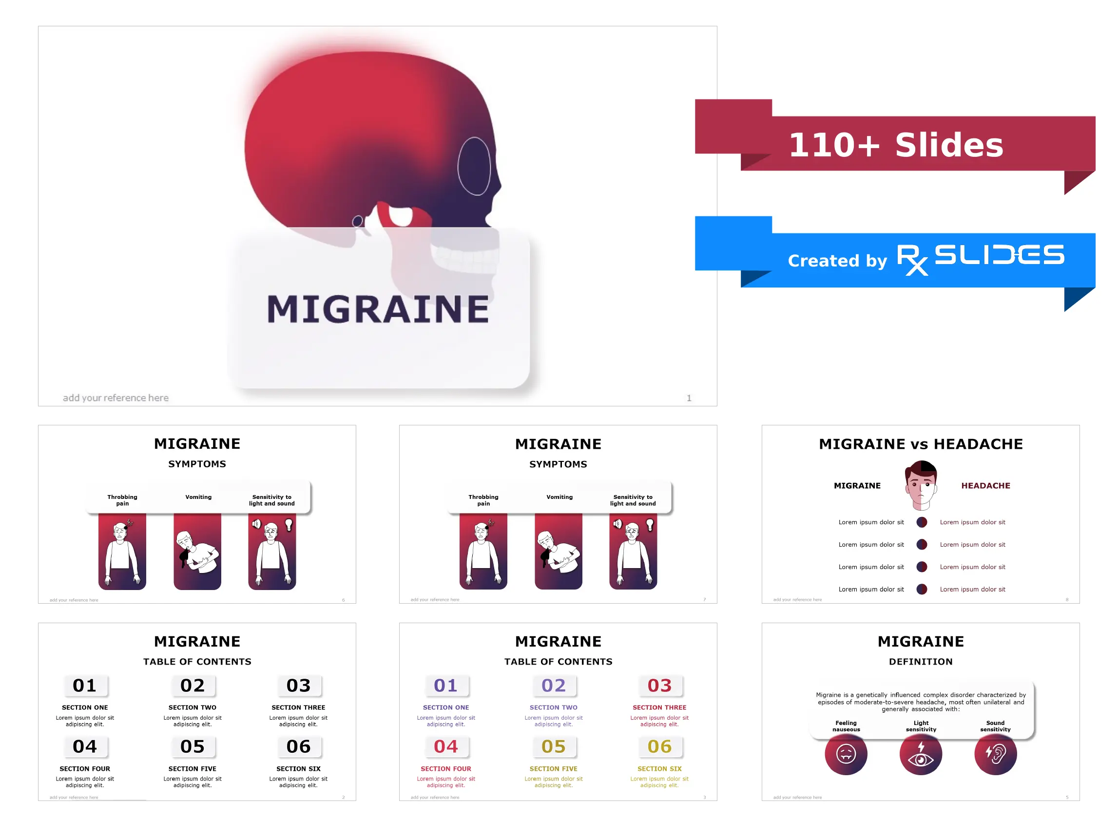 Download Migraine PowerPoint Template|RxSlides