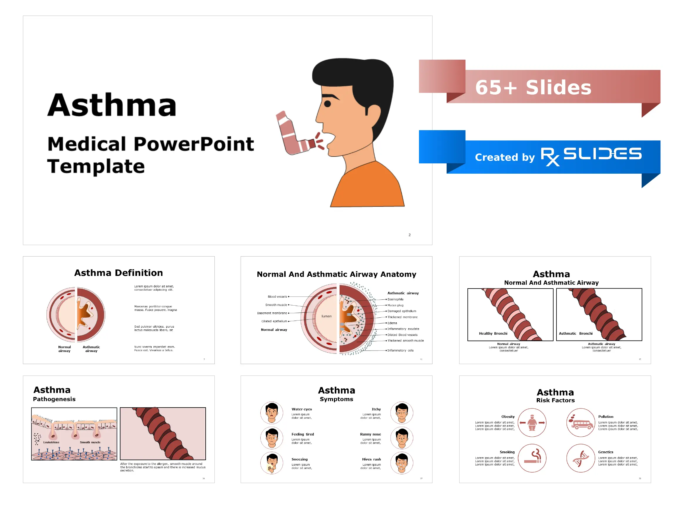 Download Asthma PowerPoint Template 1| RxSlides