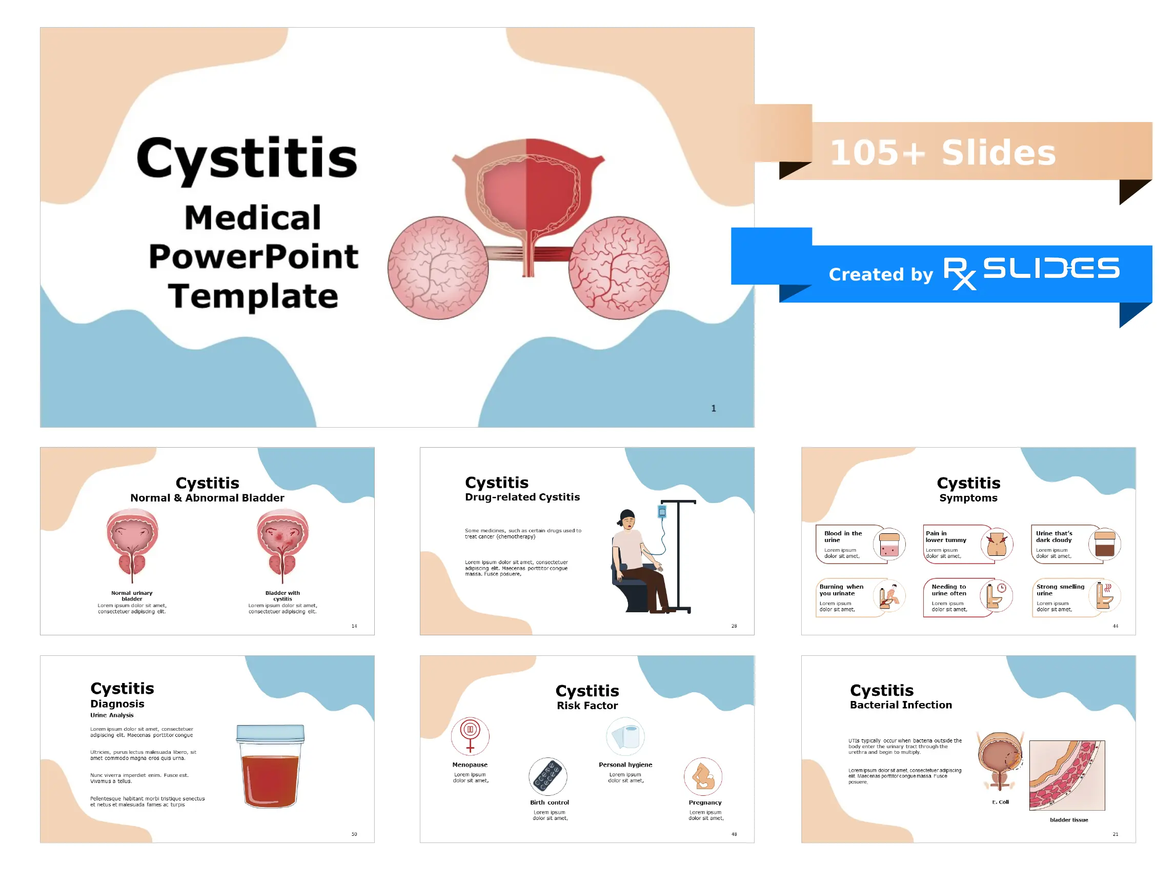 Download Cystitis PowerPoint Template| RxSlides