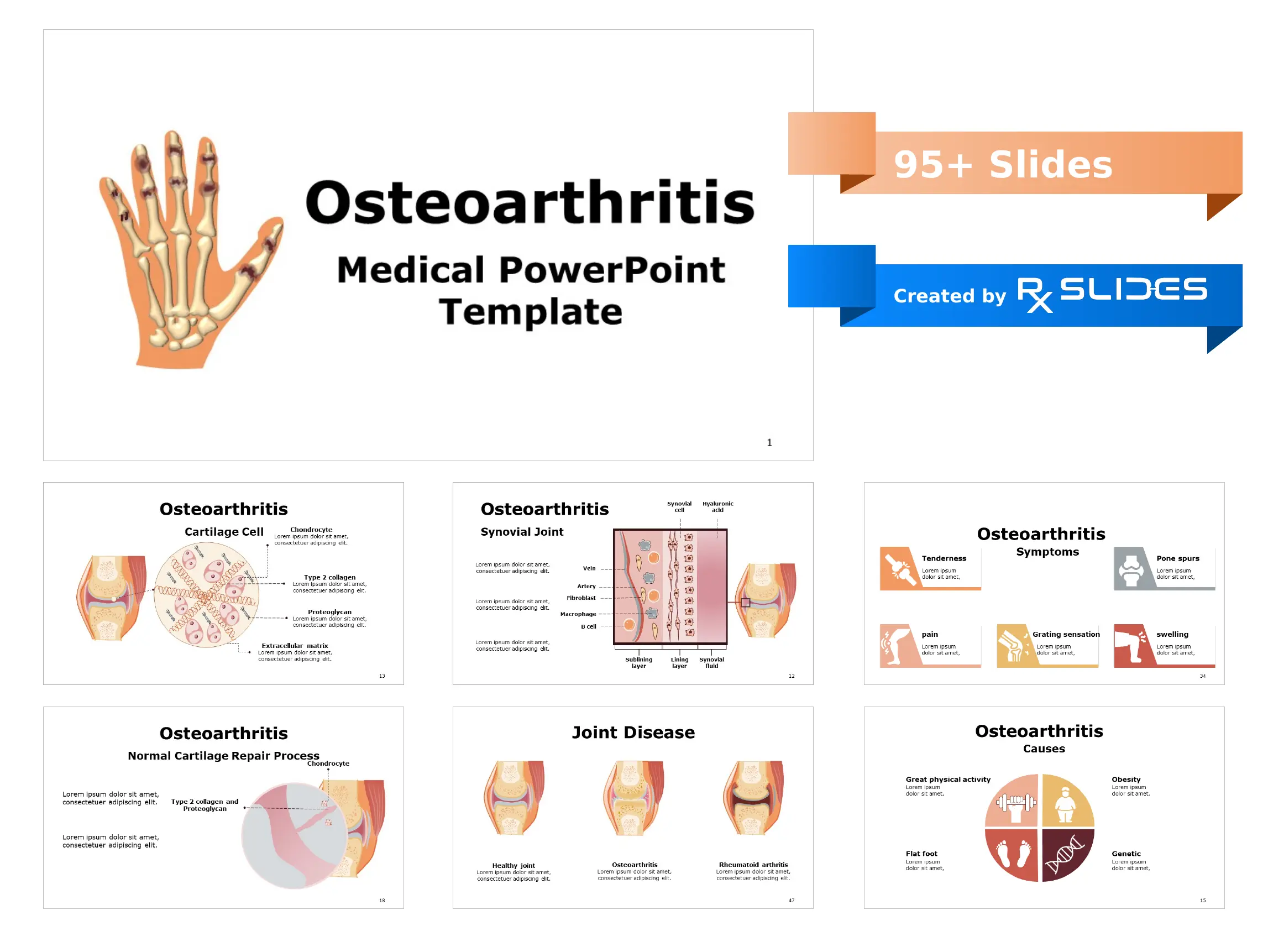 Download Osteoarthritis PowerPoint Template|RxSlides
