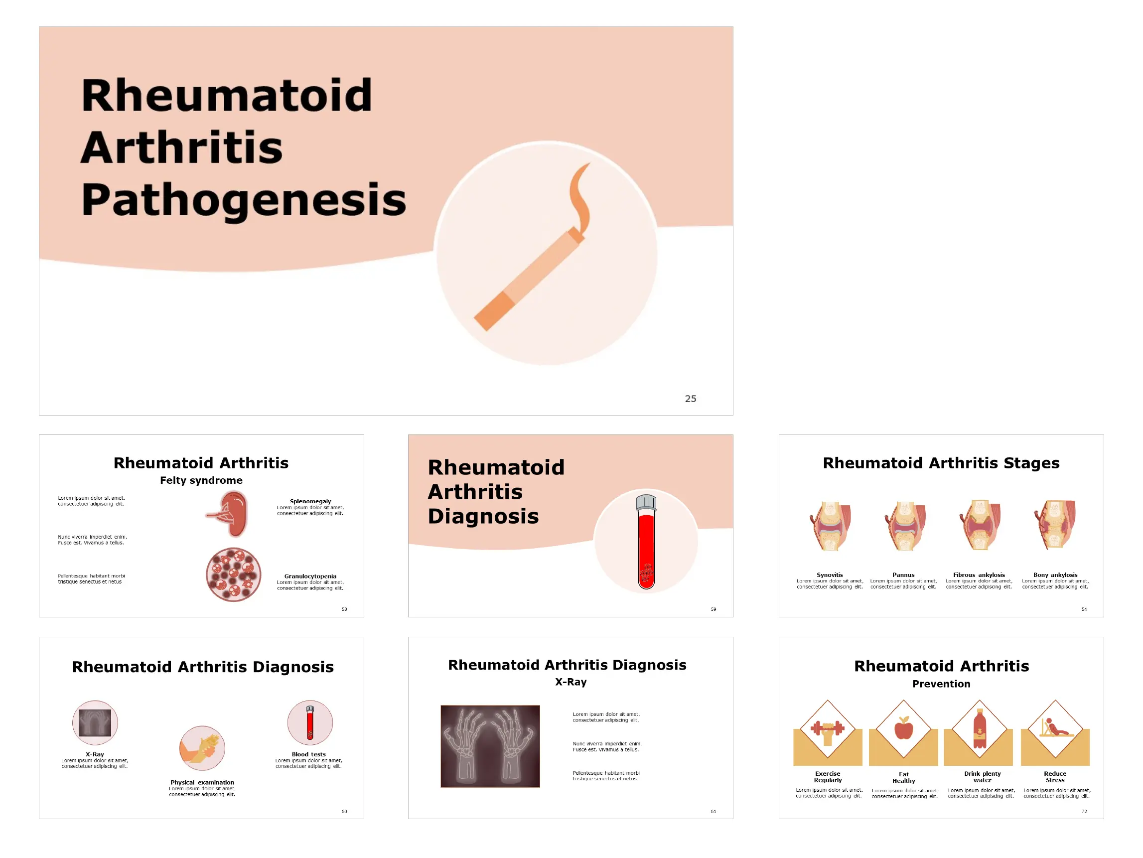 Download Rheumatoid Arthritis PowerPoint Template|RxSlides