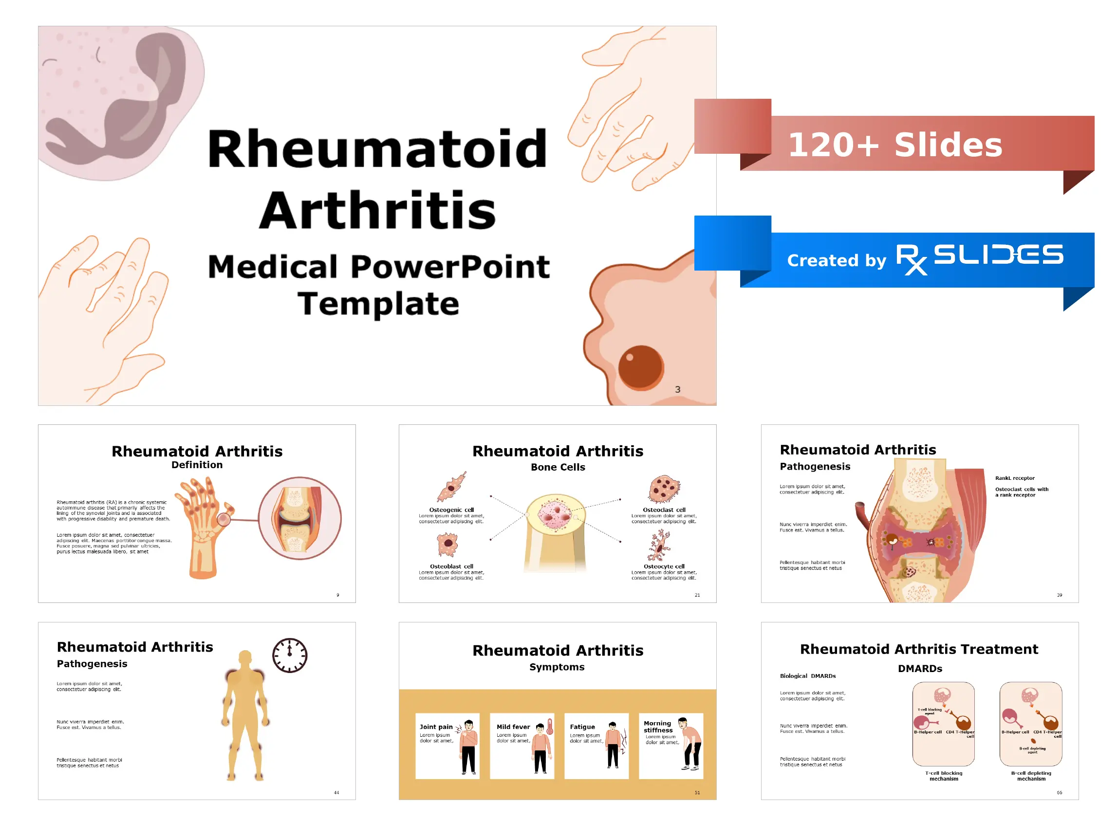 Download Rheumatoid Arthritis PowerPoint Template|RxSlides