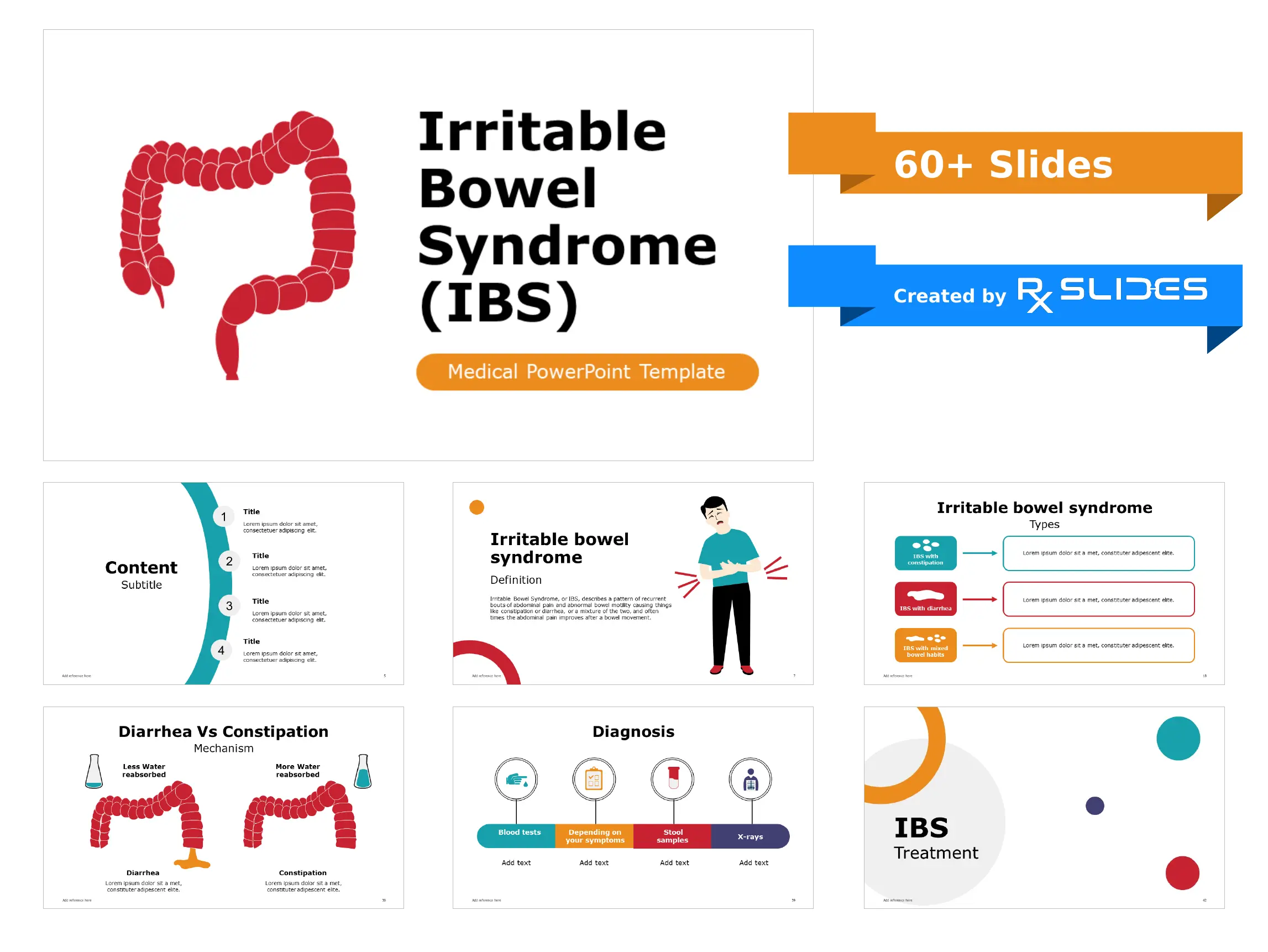 Download Irritable bowel syndrome (IBS) PowerPoint Template| RxSlides