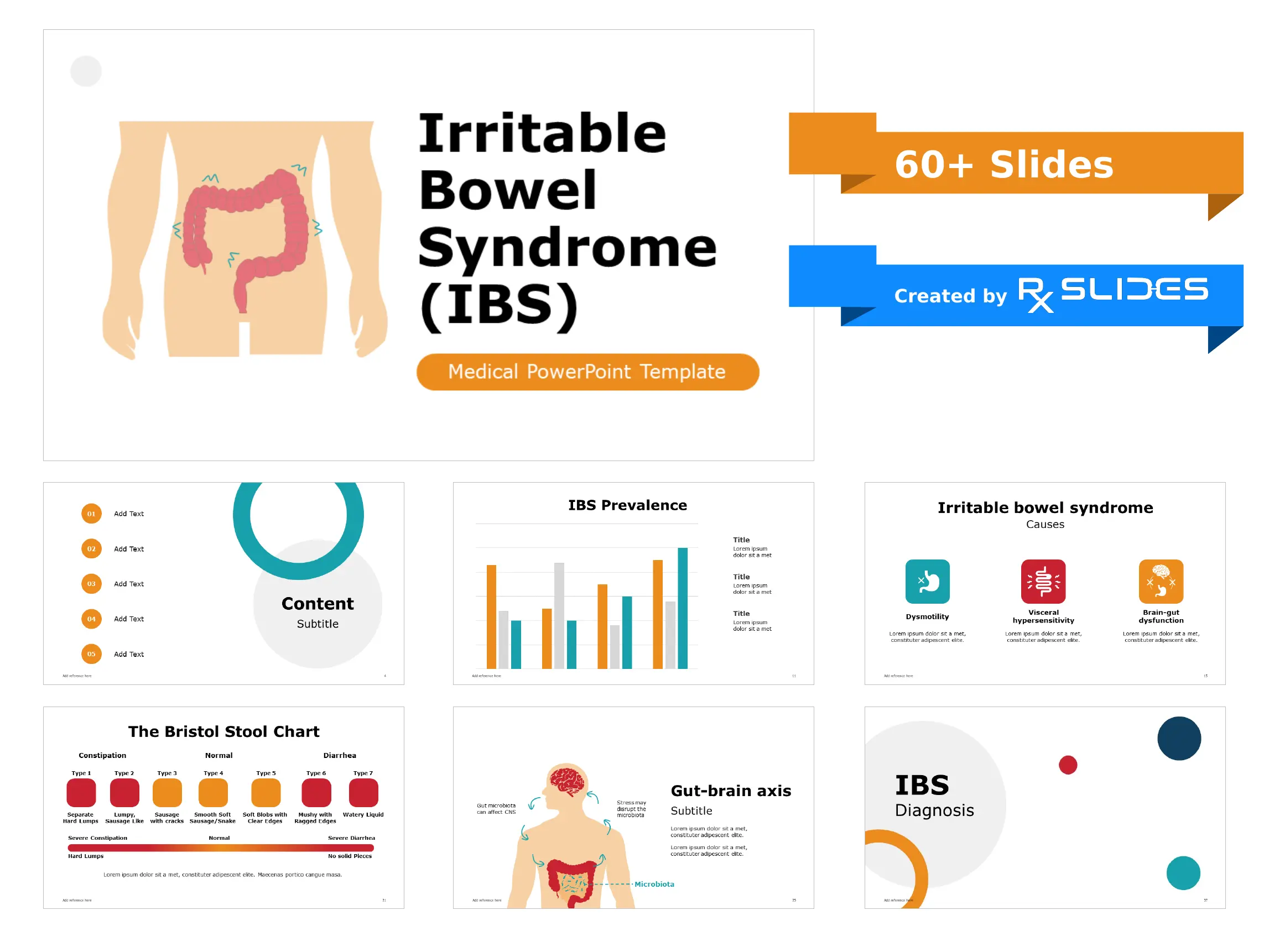 Download Irritable bowel syndrome (IBS) PowerPoint Template| RxSlides