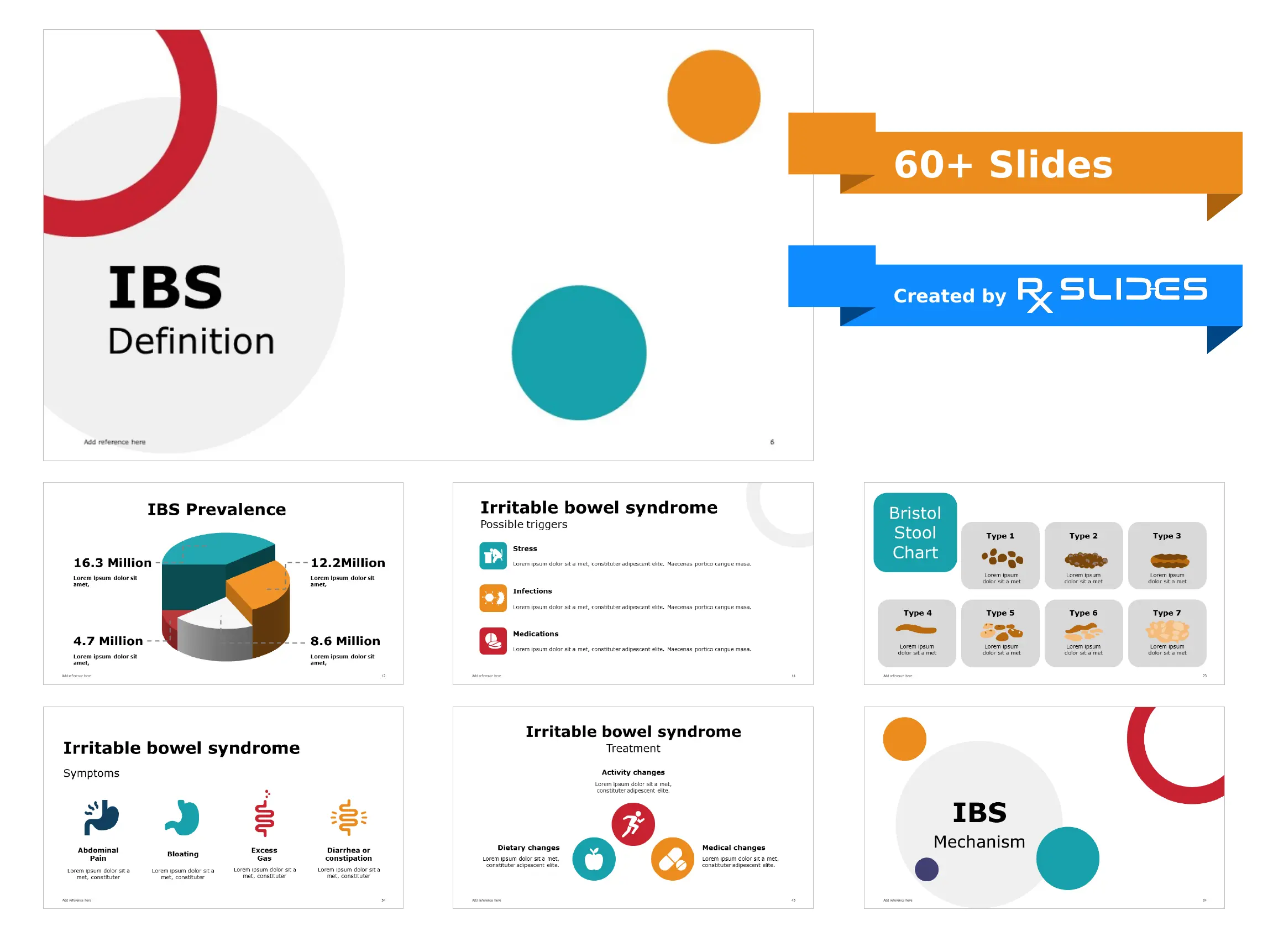 Download Irritable bowel syndrome (IBS) PowerPoint Template| RxSlides