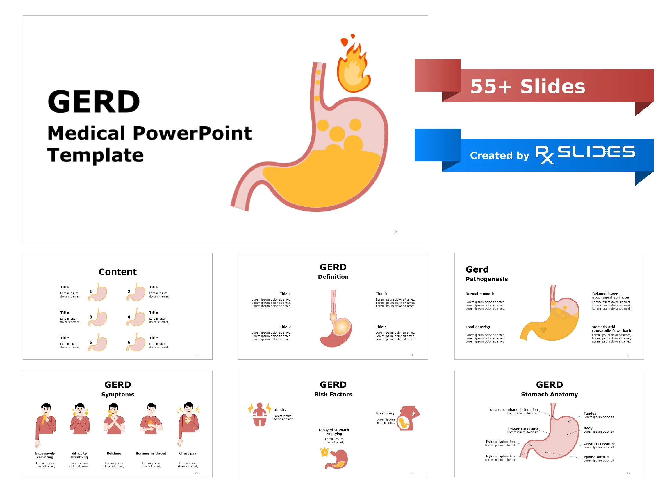 Download Gastroesophageal reflux disease (Gerd) PowerPoint Template ...