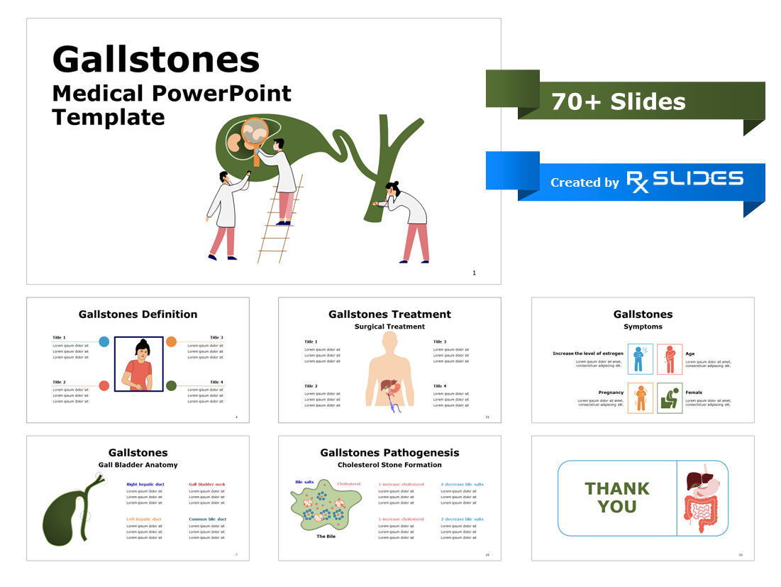 Download Gallstones PowerPoint Template| RxSlides
