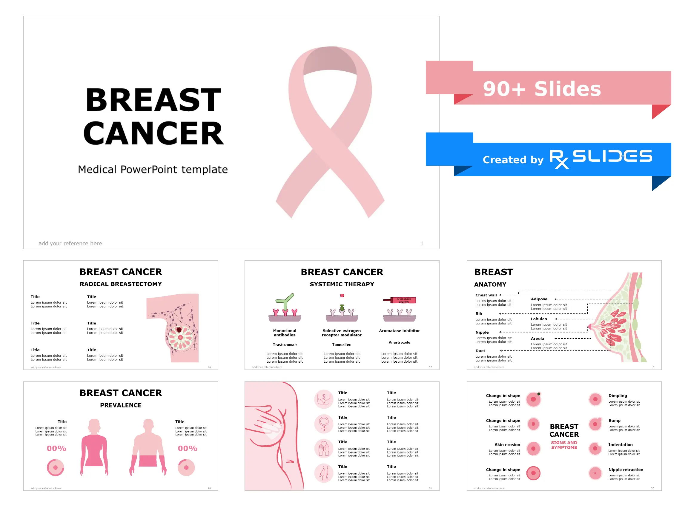 Download Breast Cancer PowerPoint Template| RxSlides