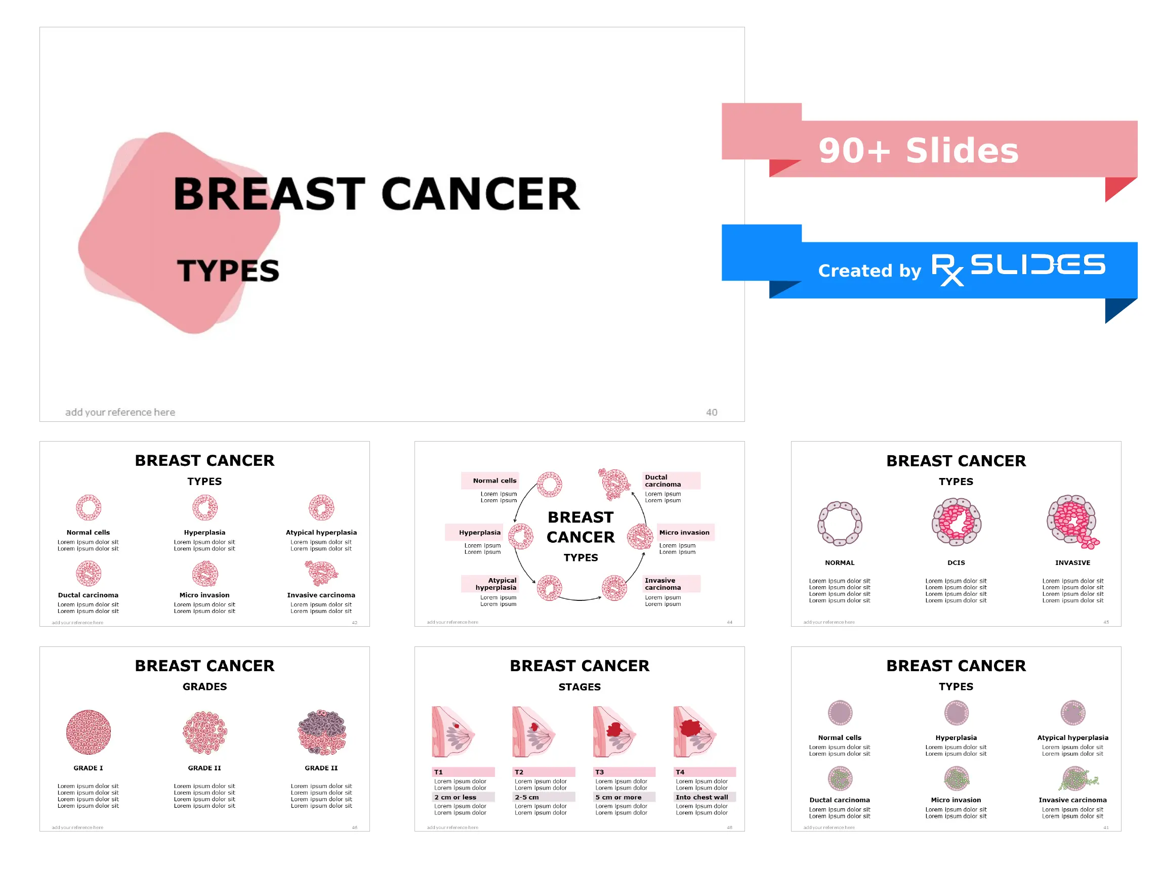 Download Breast Cancer PowerPoint Template| RxSlides