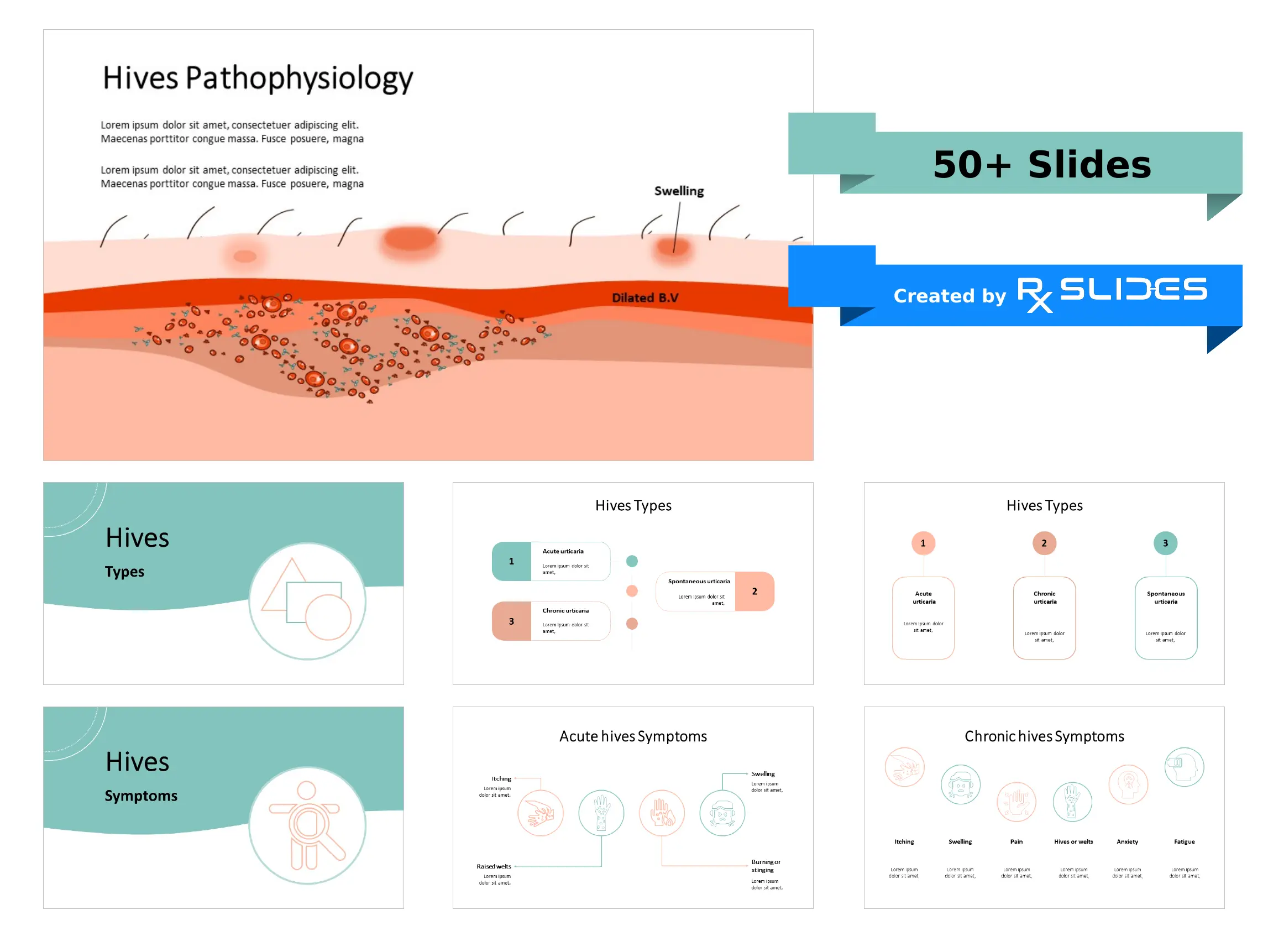Download Urticaria-Hives PowerPoint Template| RxSlides