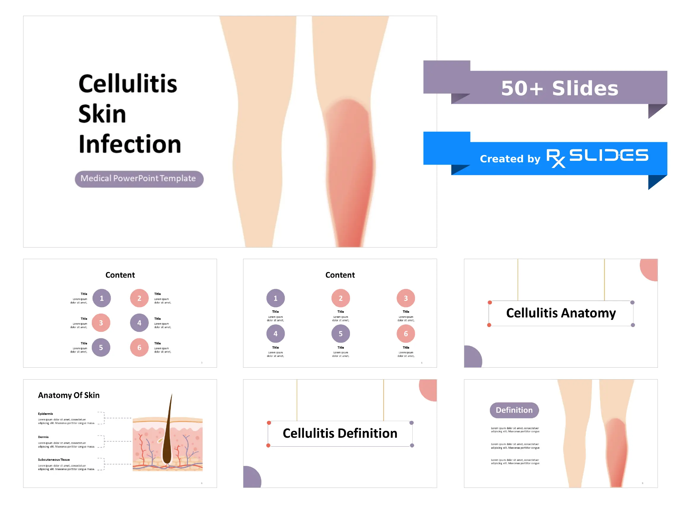 Cellulitis PowerPoint Template | RxSlides The largest online store for ...