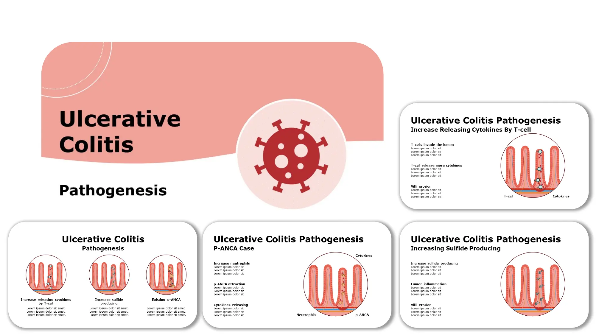 Download Ulcerative Colitis PowerPoint Template| RxSlides