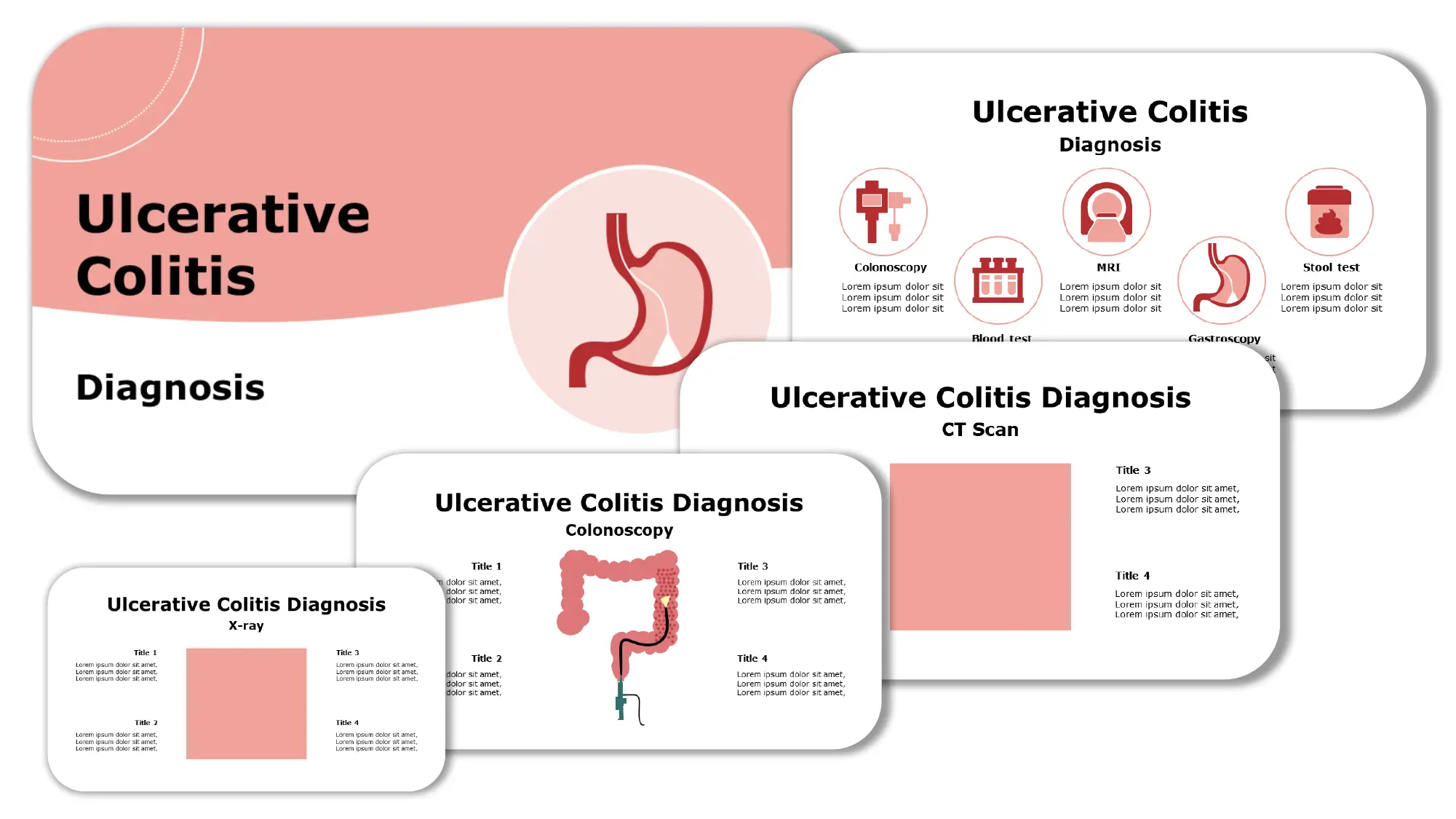 Download Ulcerative Colitis PowerPoint Template| RxSlides