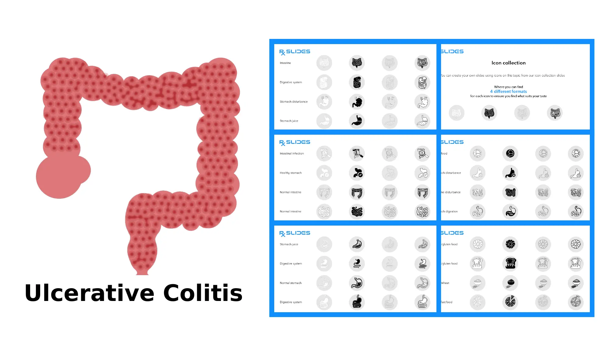 Download Ulcerative Colitis PowerPoint Template| RxSlides