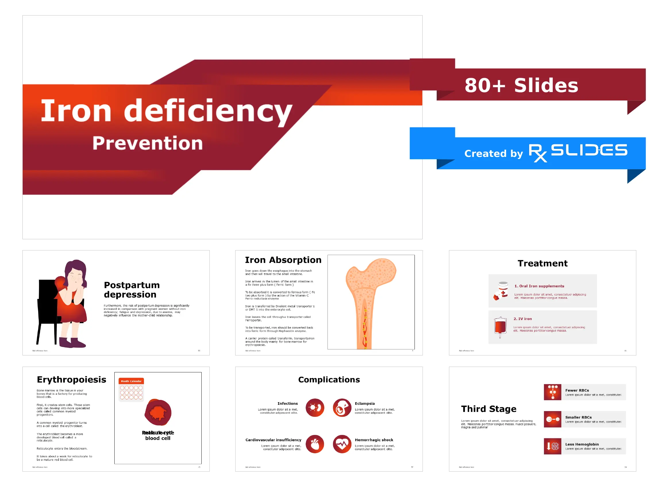 Download Iron Deficiency Anemia PowerPoint Template | RxSlides