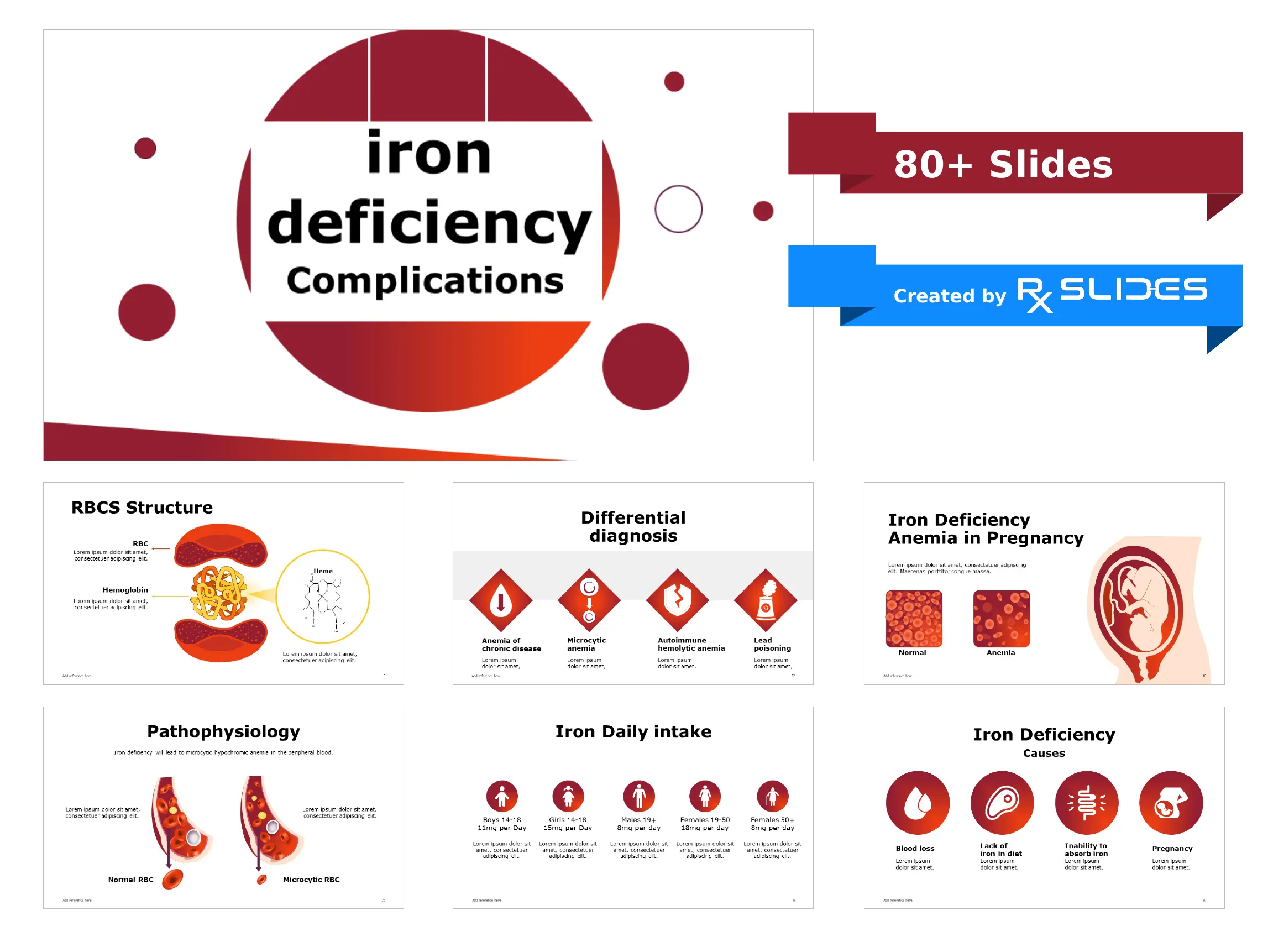 Download Iron Deficiency Anemia PowerPoint Template | RxSlides
