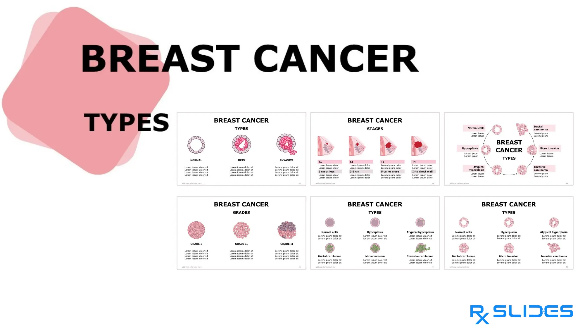 Download Breast Cancer PowerPoint Template| RxSlides