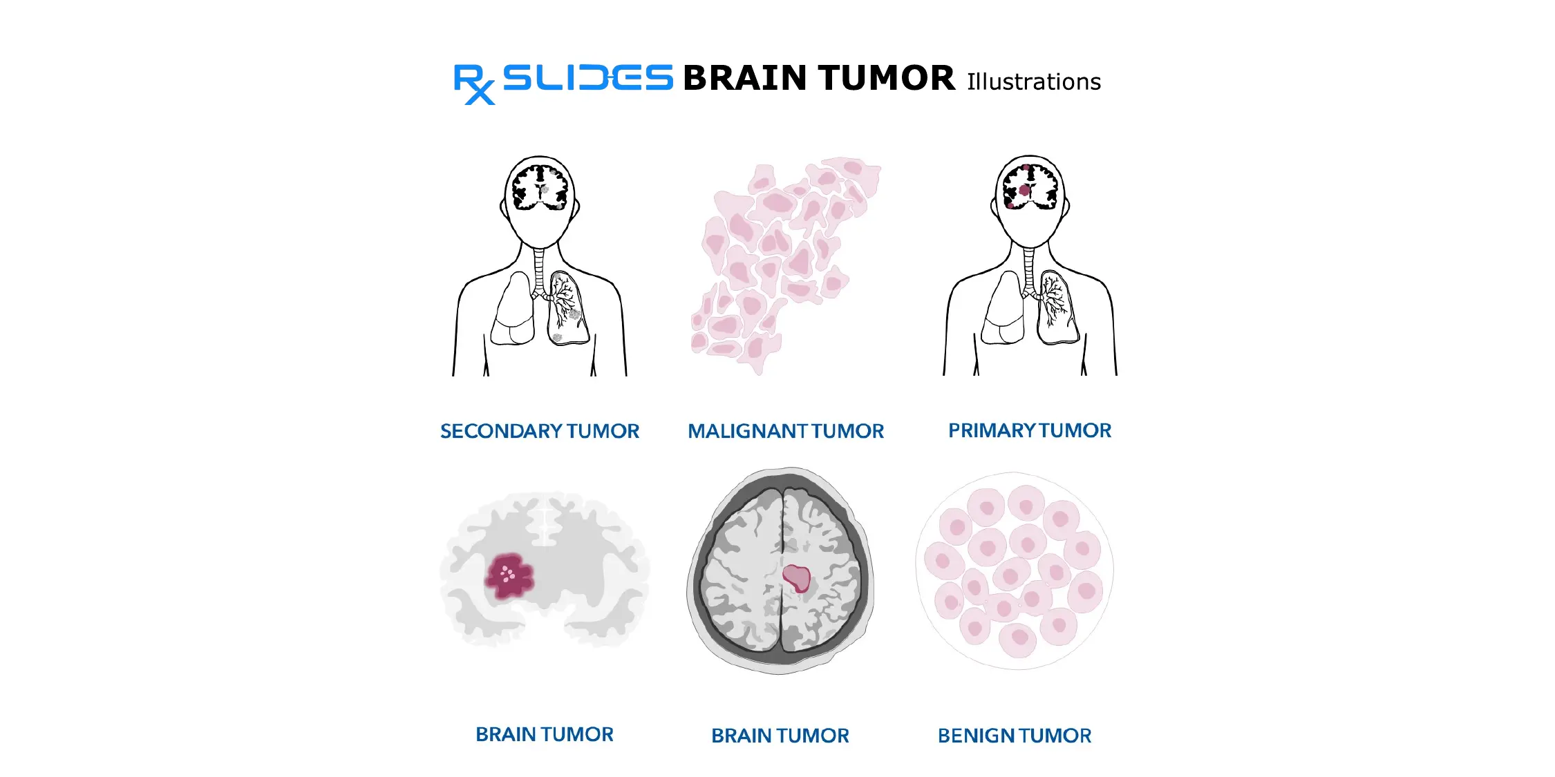 Download Brain Tumor PowerPoint Template| RxSlides