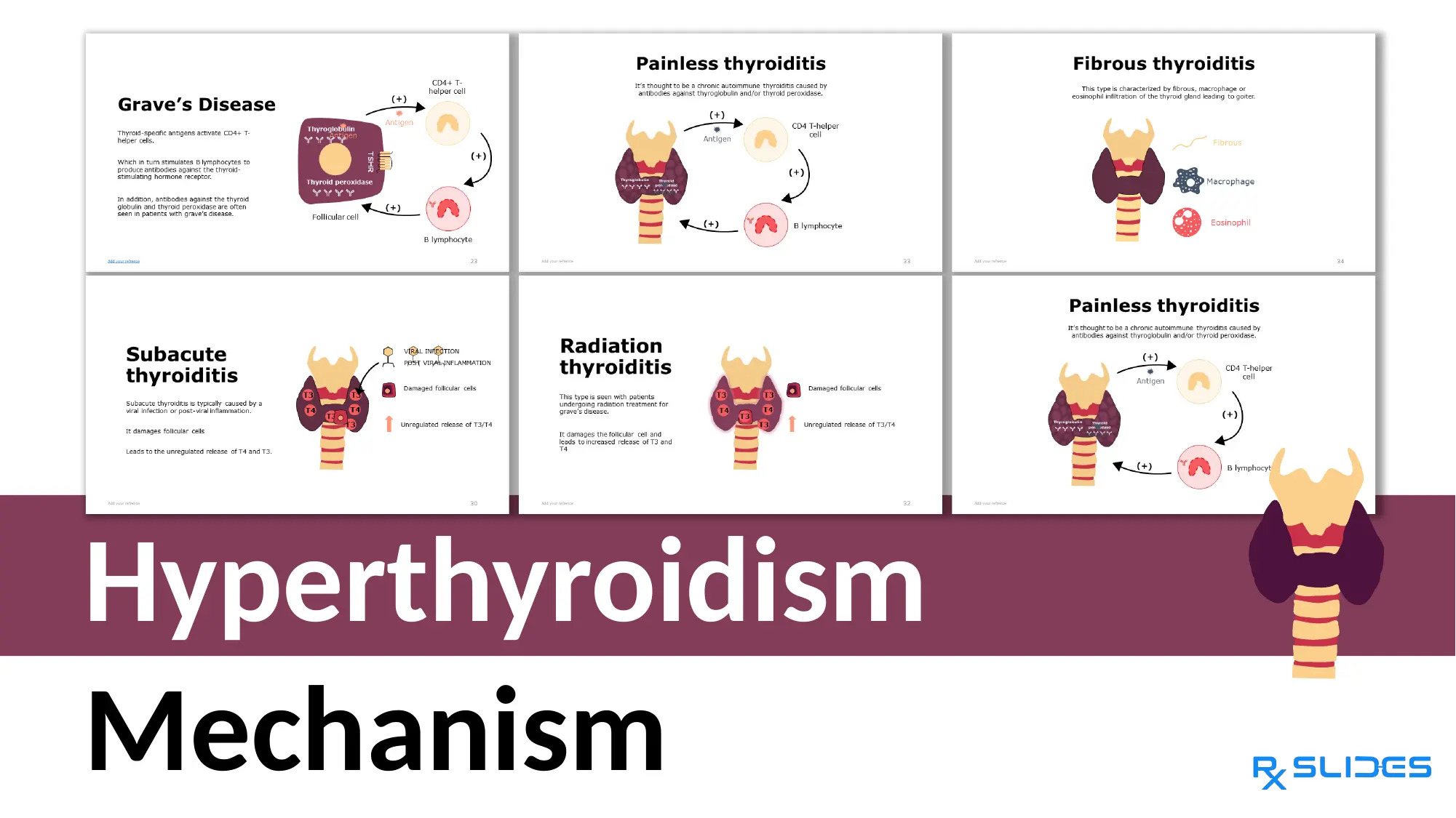 Download Hyperthyroidism PowerPoint Template|RxSlides