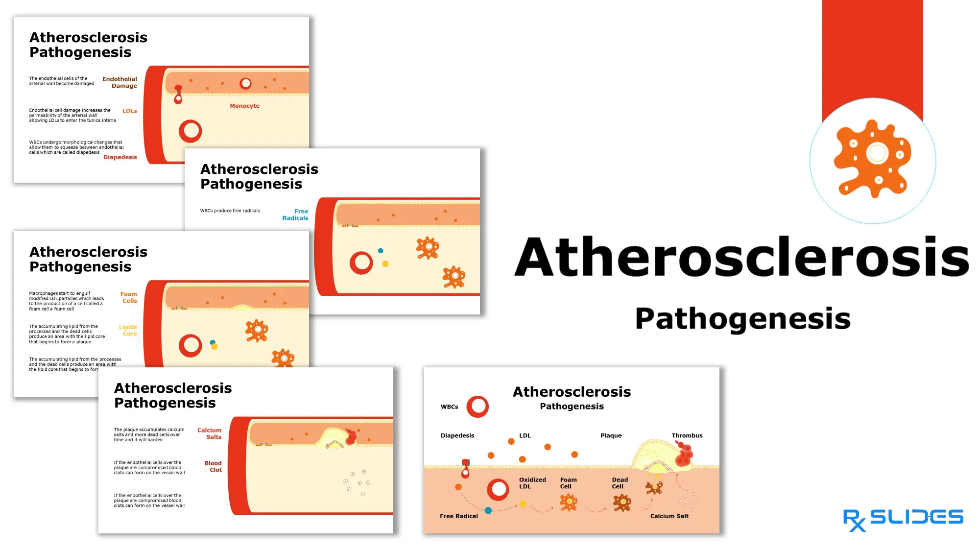 Download Atherosclerosis PowerPoint Template| RxSlides