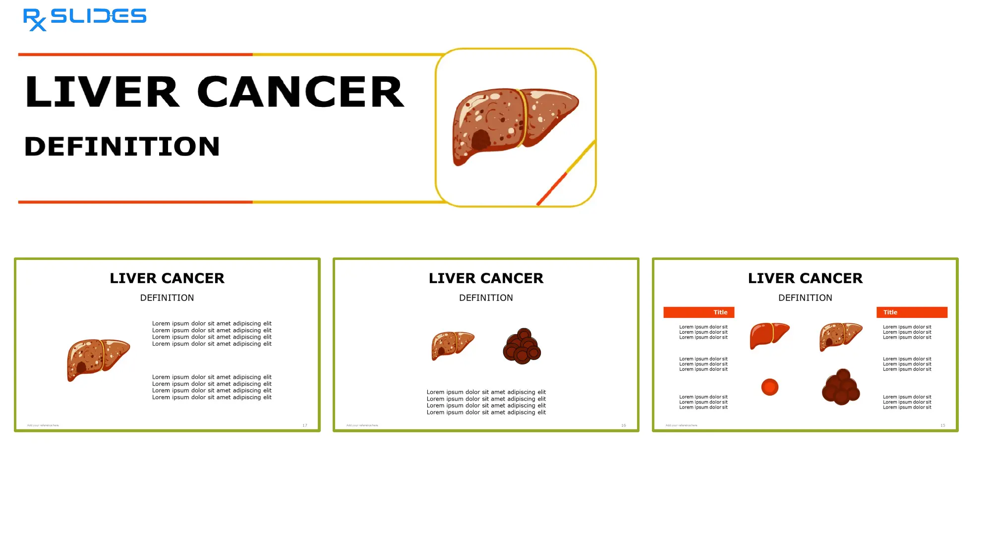 Download liver Cancer PowerPoint Template|