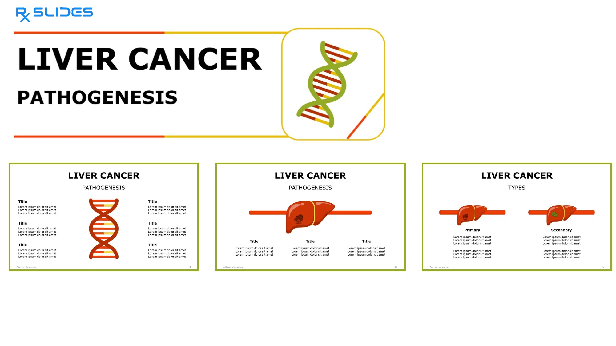 Download liver Cancer PowerPoint Template|