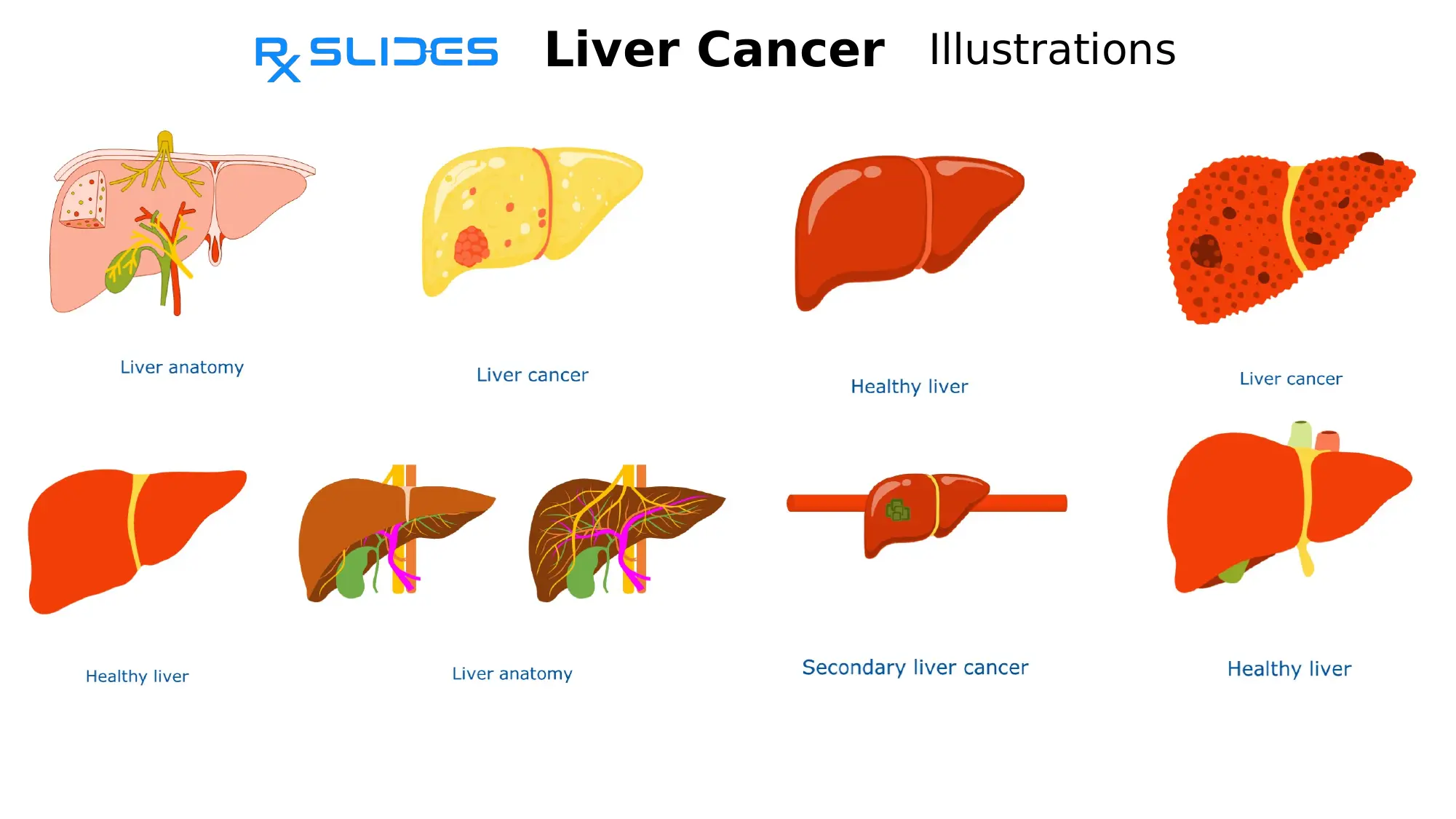Download liver Cancer PowerPoint Template|