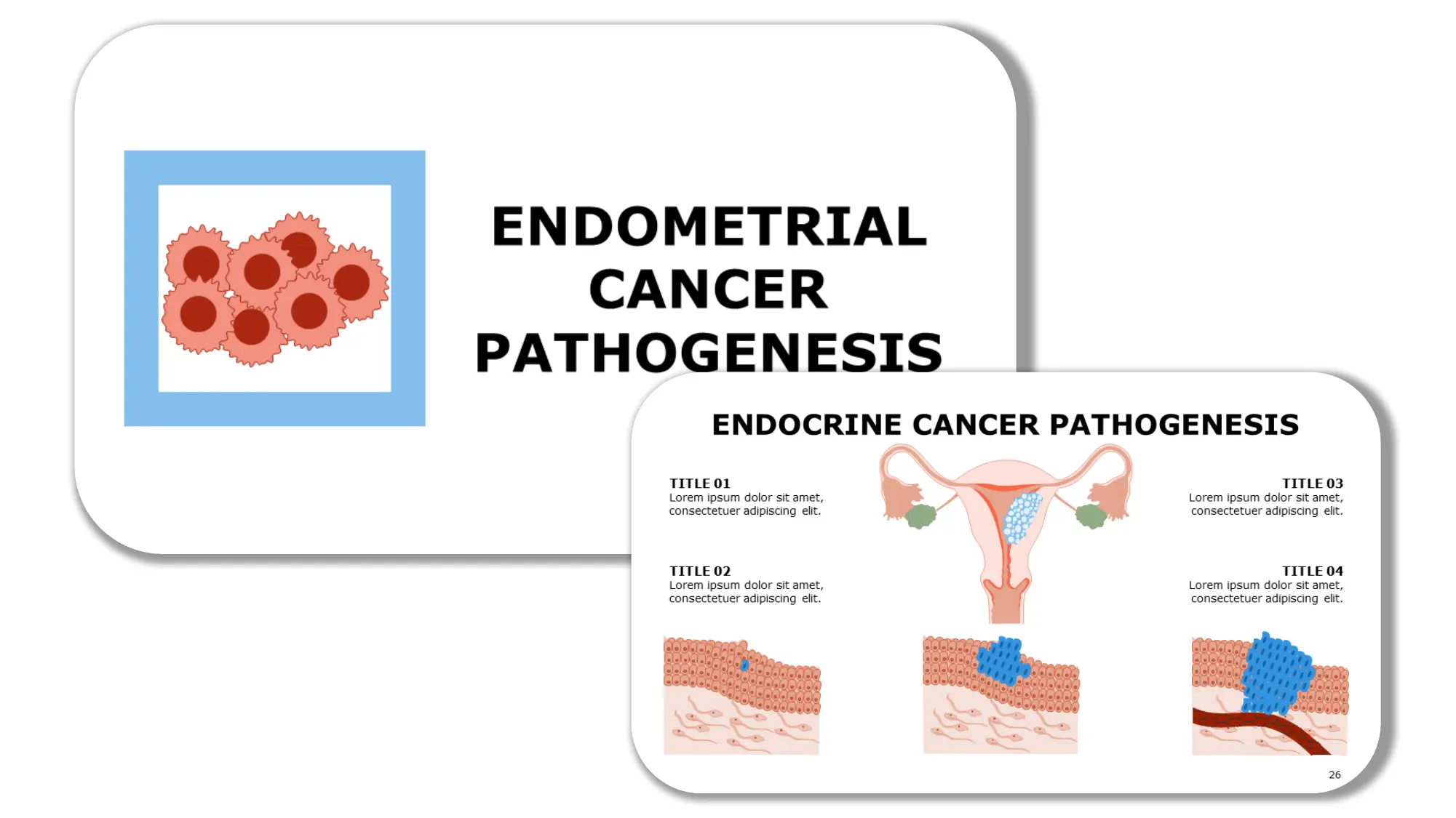 Download Endometrial Cancer PowerPoint Template| RxSlides