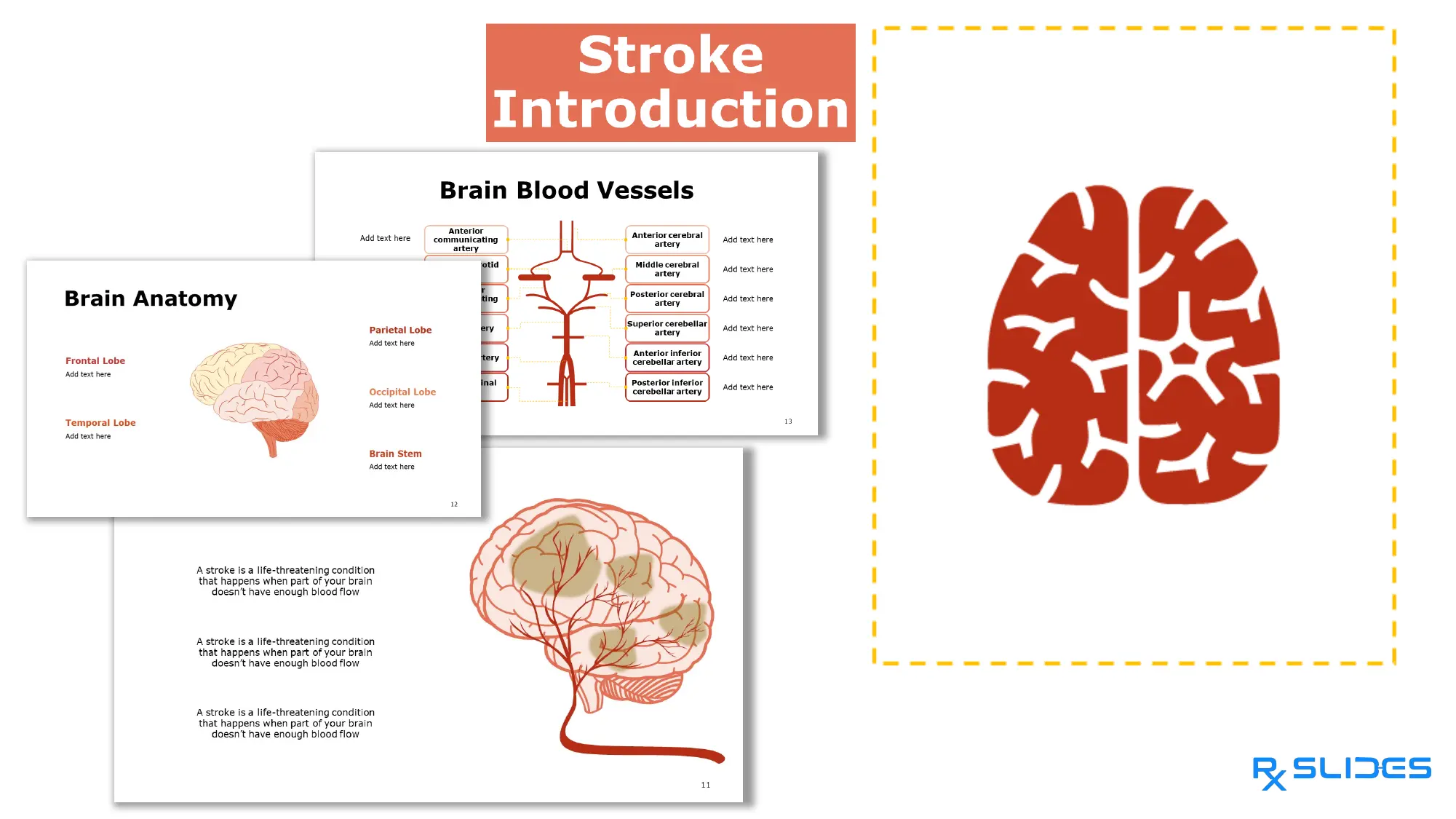 Download Stroke PowerPoint Template|