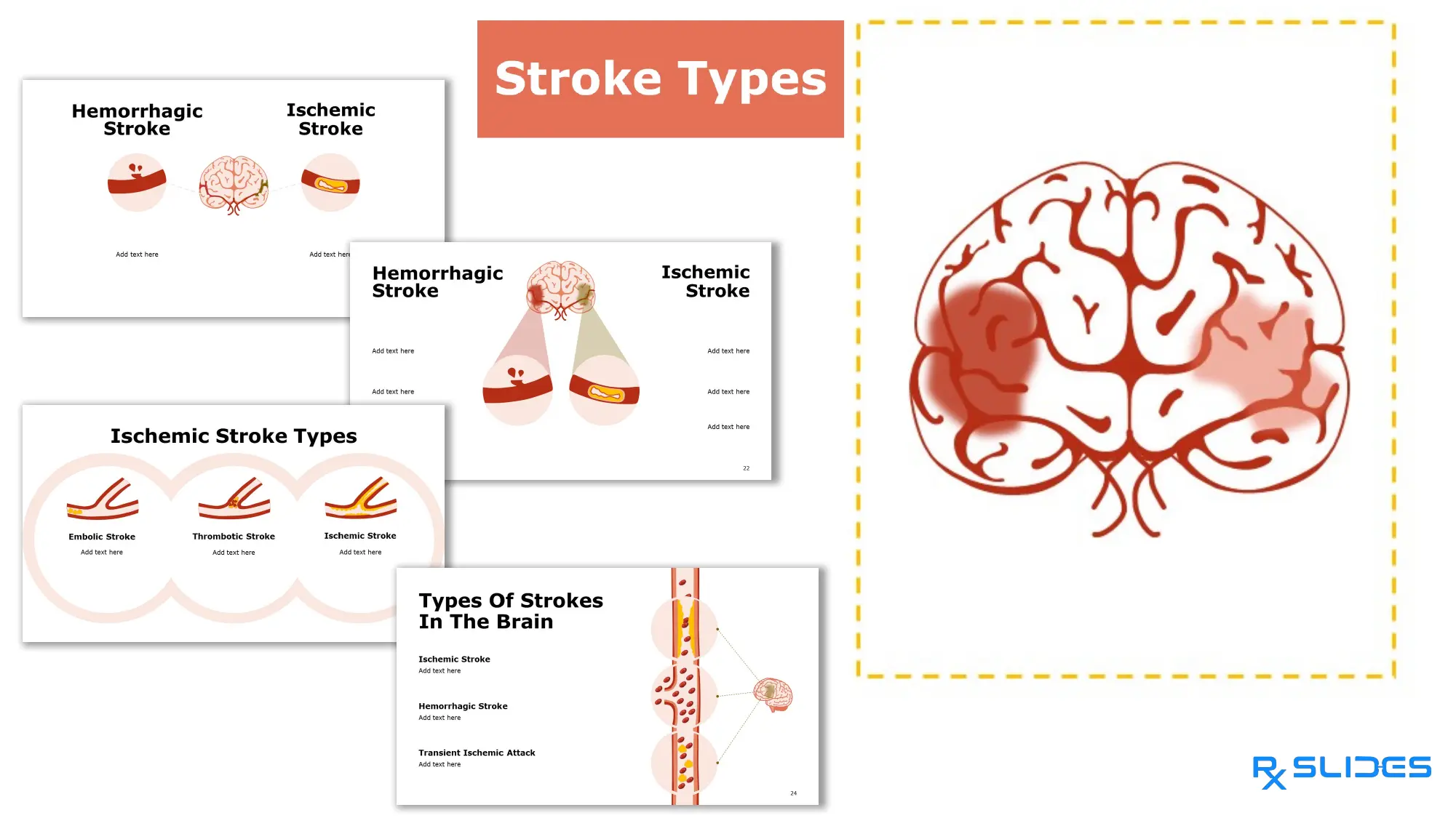 Download Stroke PowerPoint Template|