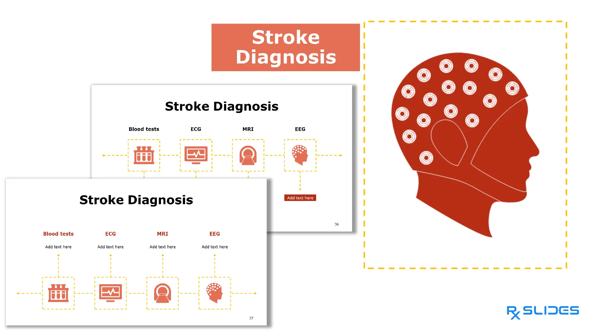 Download Stroke PowerPoint Template|