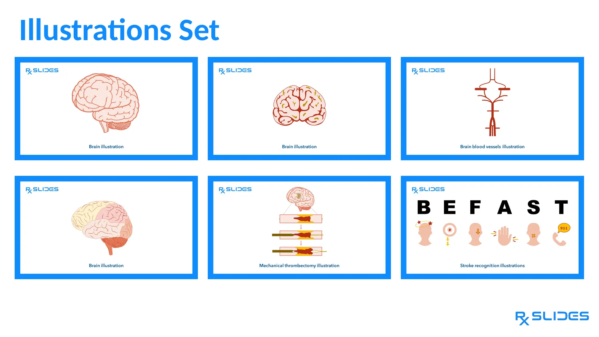 Download Stroke PowerPoint Template|