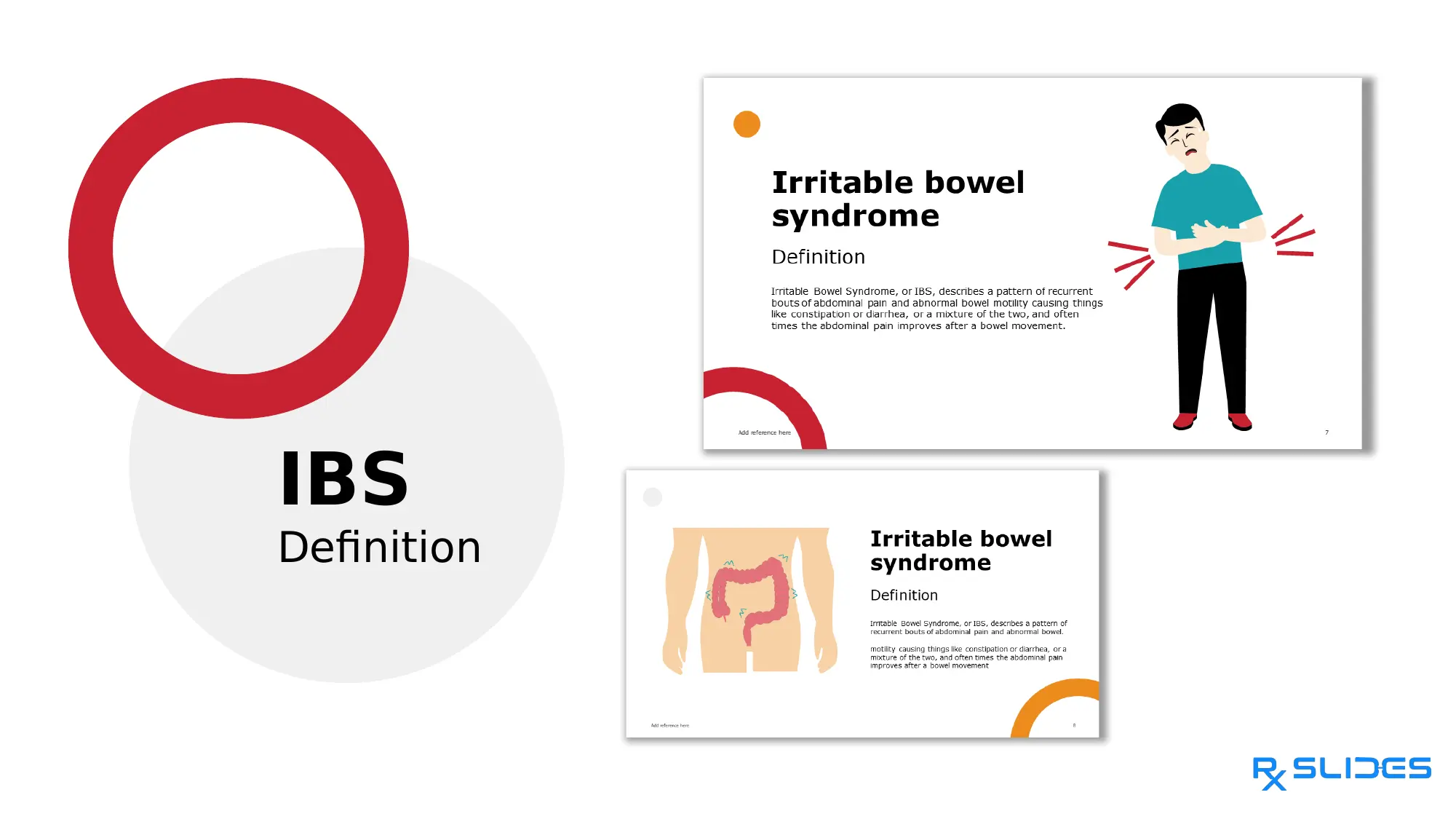 Download Irritable bowel syndrome (IBS) PowerPoint Template| RxSlides