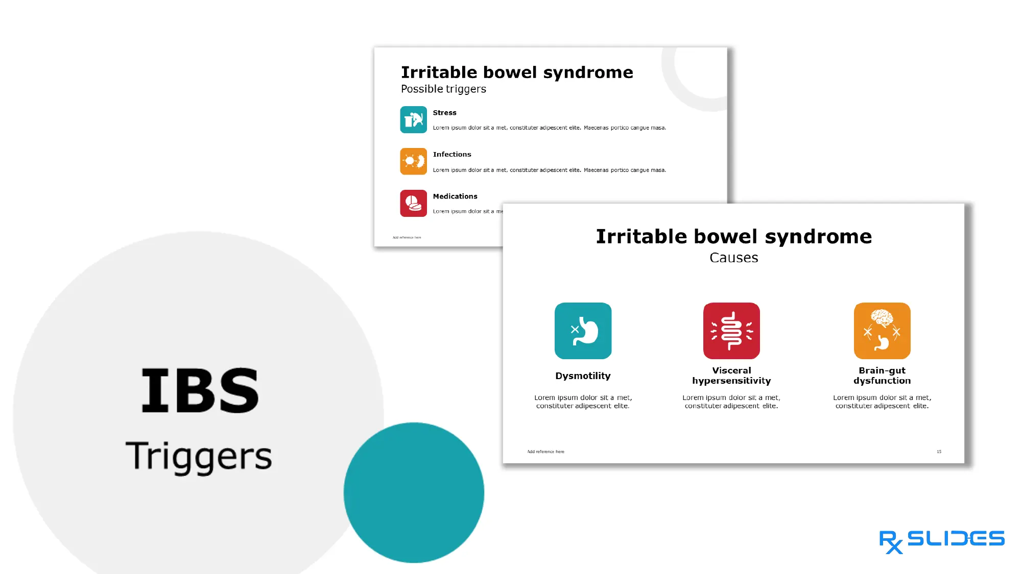 Download Irritable bowel syndrome (IBS) PowerPoint Template| RxSlides