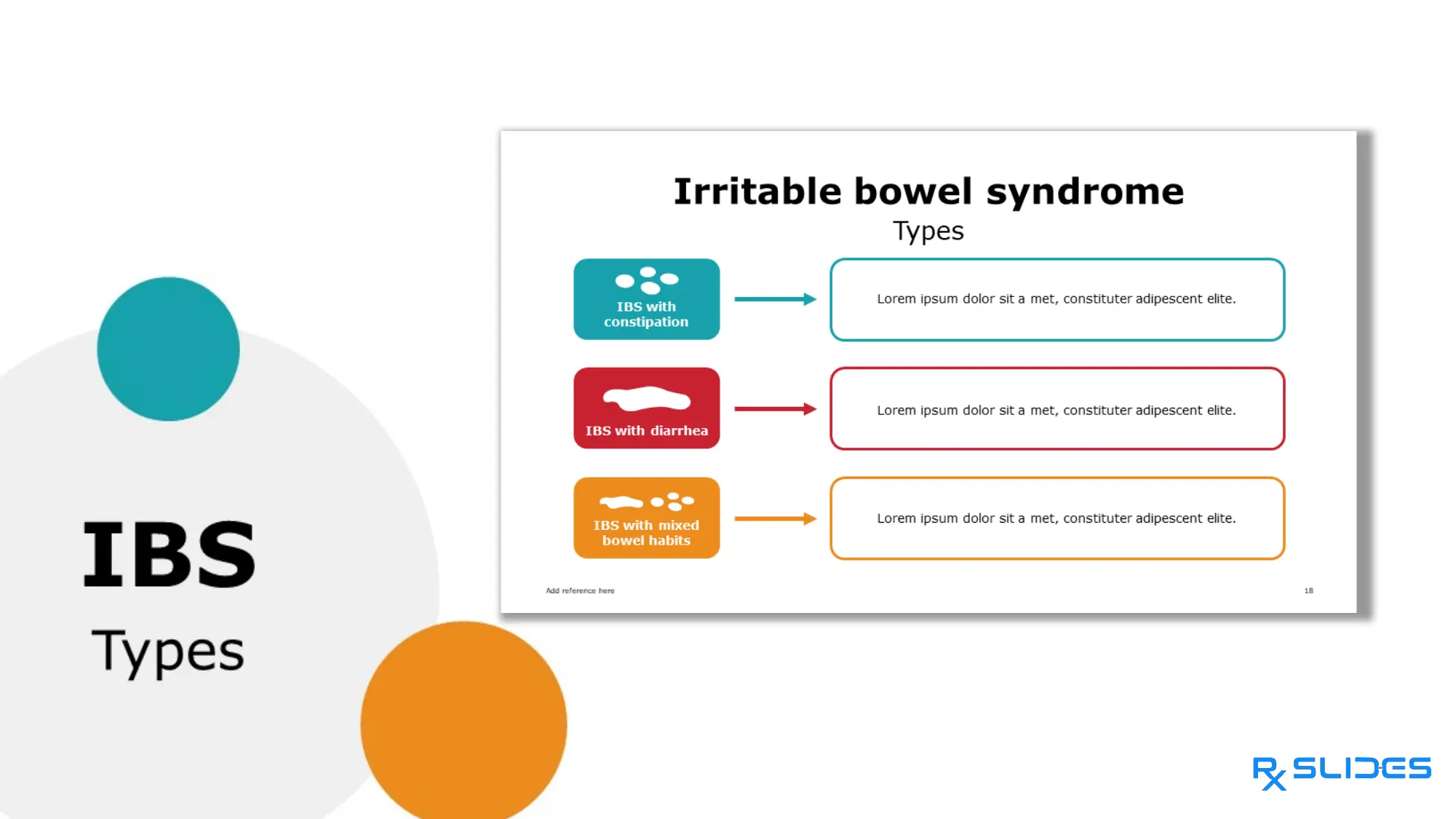 Download Irritable bowel syndrome (IBS) PowerPoint Template| RxSlides