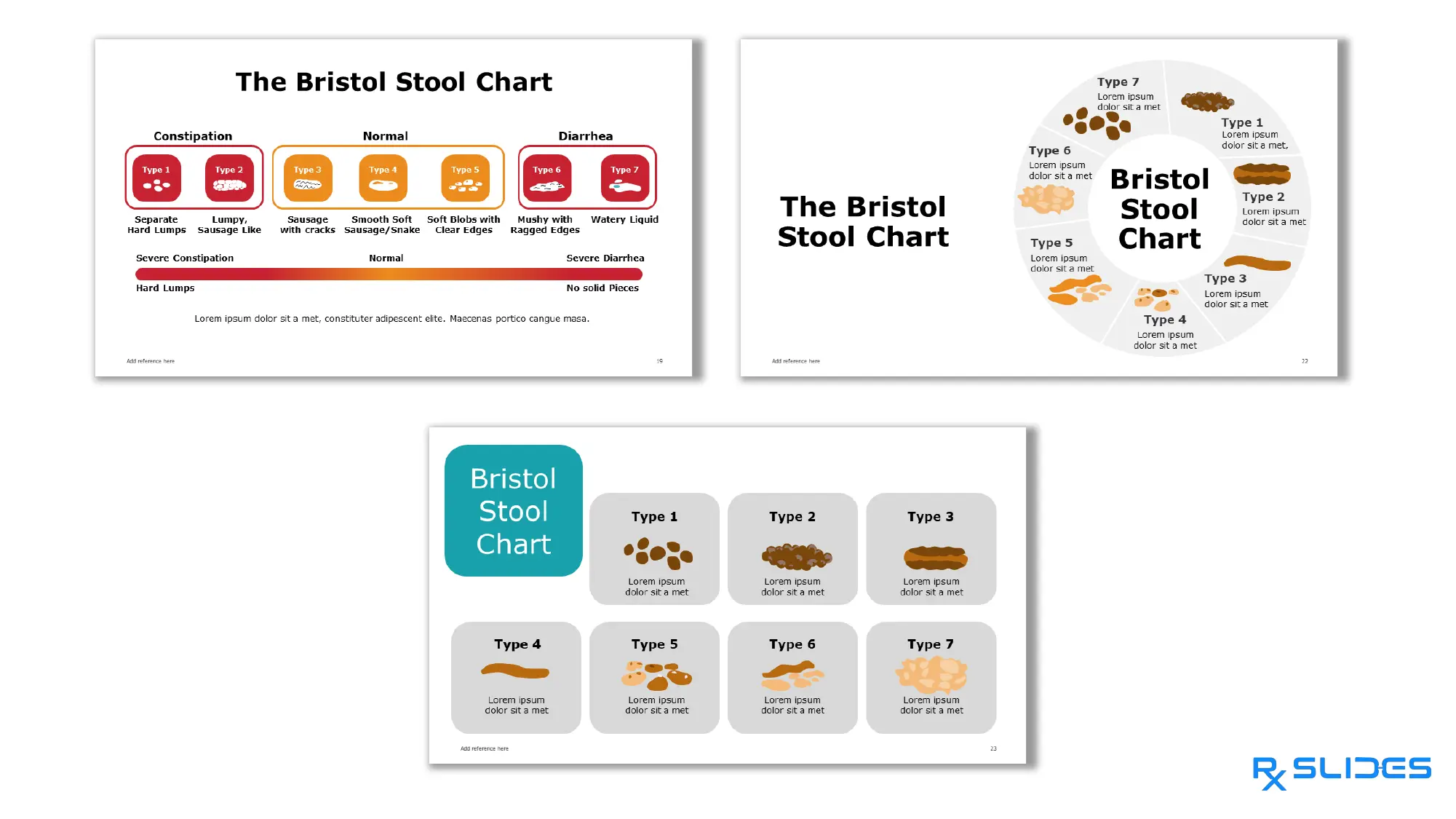 Download Irritable bowel syndrome (IBS) PowerPoint Template| RxSlides