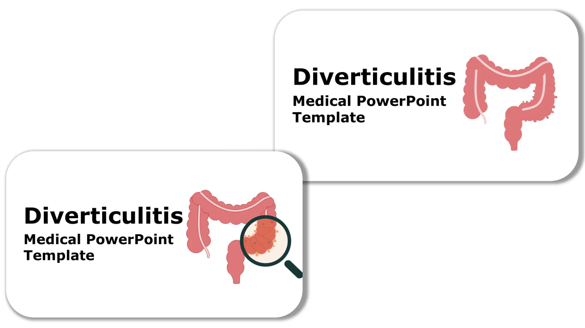 Download Diverticulitis PowerPoint Template| RxSlides