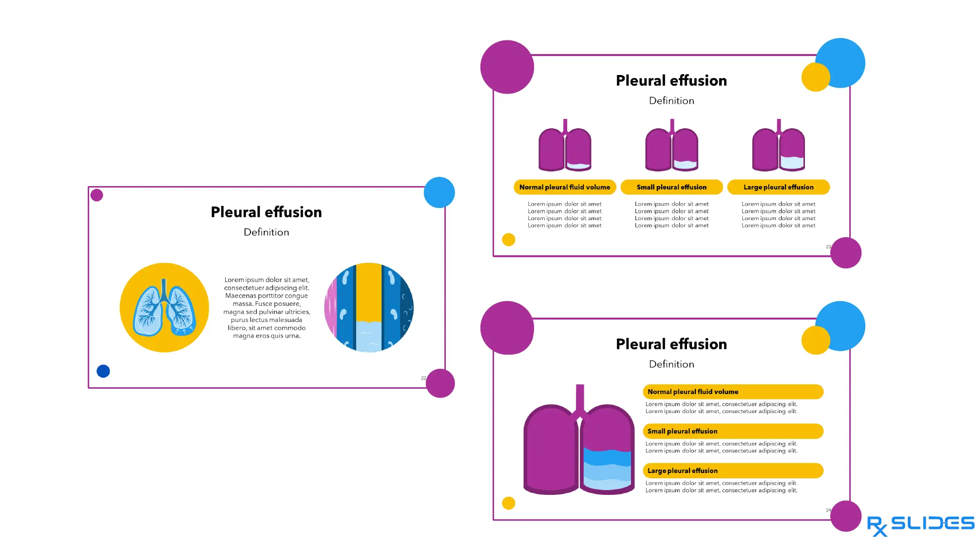Download Pleural Effusion PowerPoint Template| RxSlides
