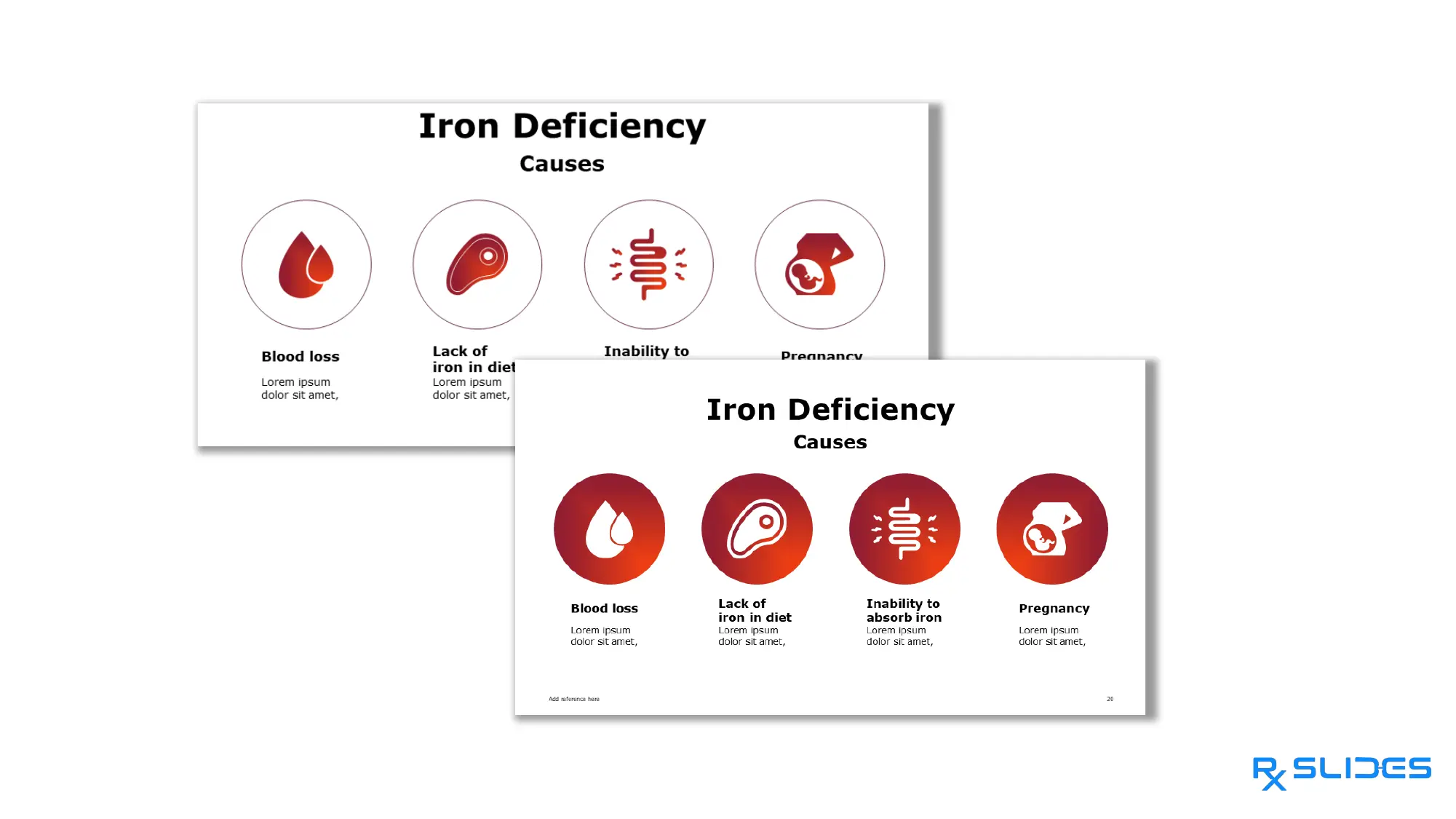 Download Iron Deficiency Anemia PowerPoint Template | RxSlides
