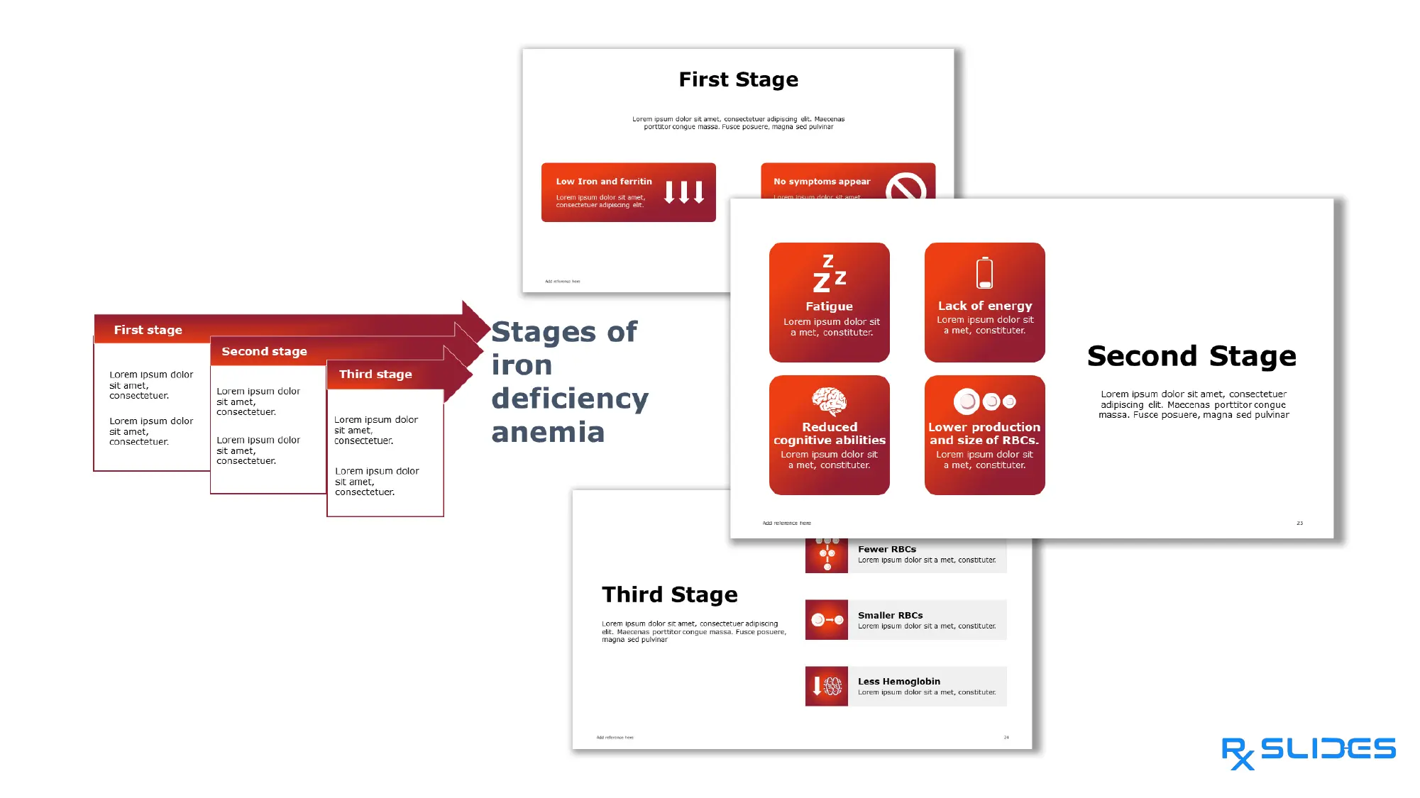 Download Iron Deficiency Anemia PowerPoint Template | RxSlides
