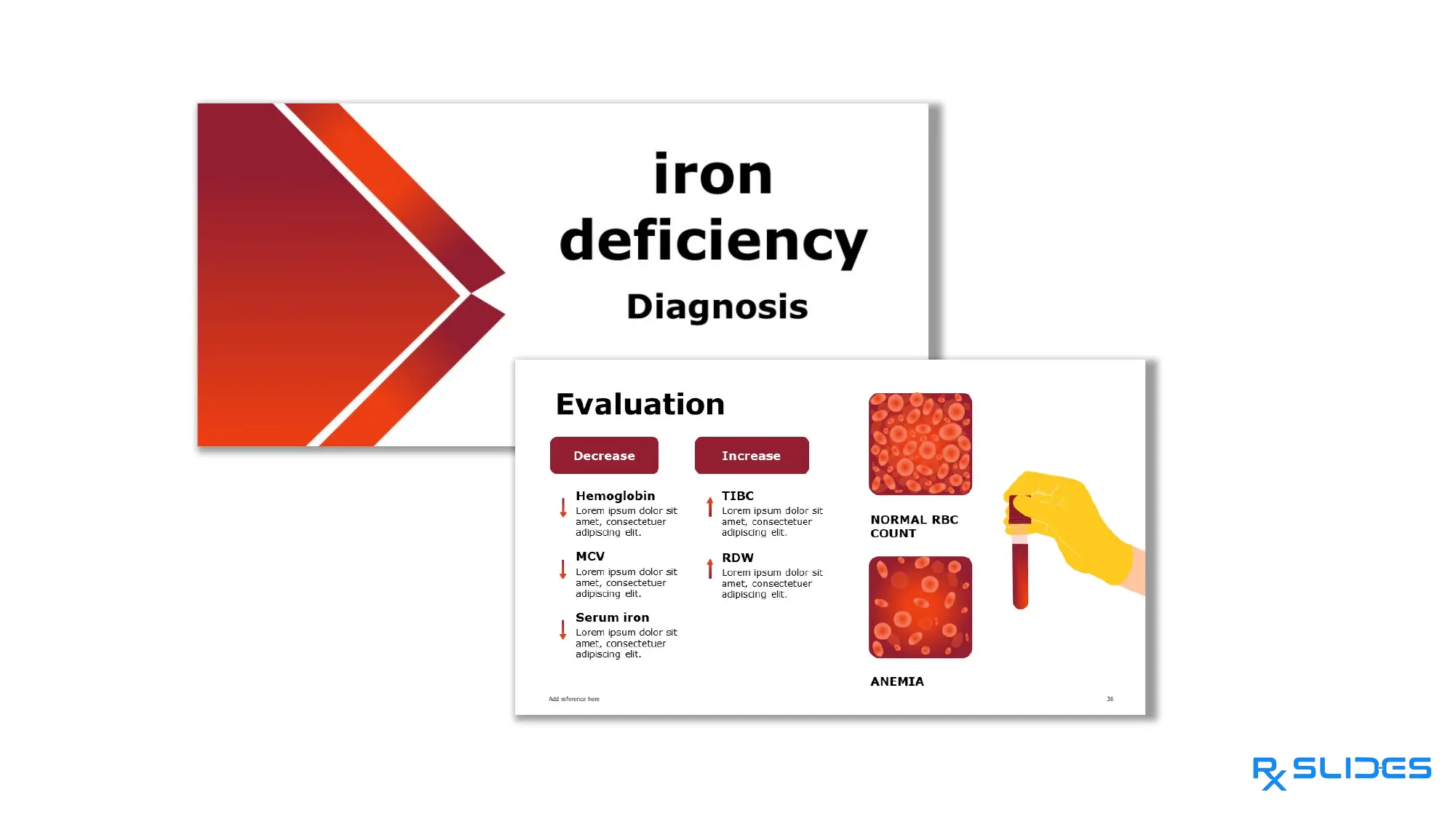 Download Iron Deficiency Anemia PowerPoint Template | RxSlides