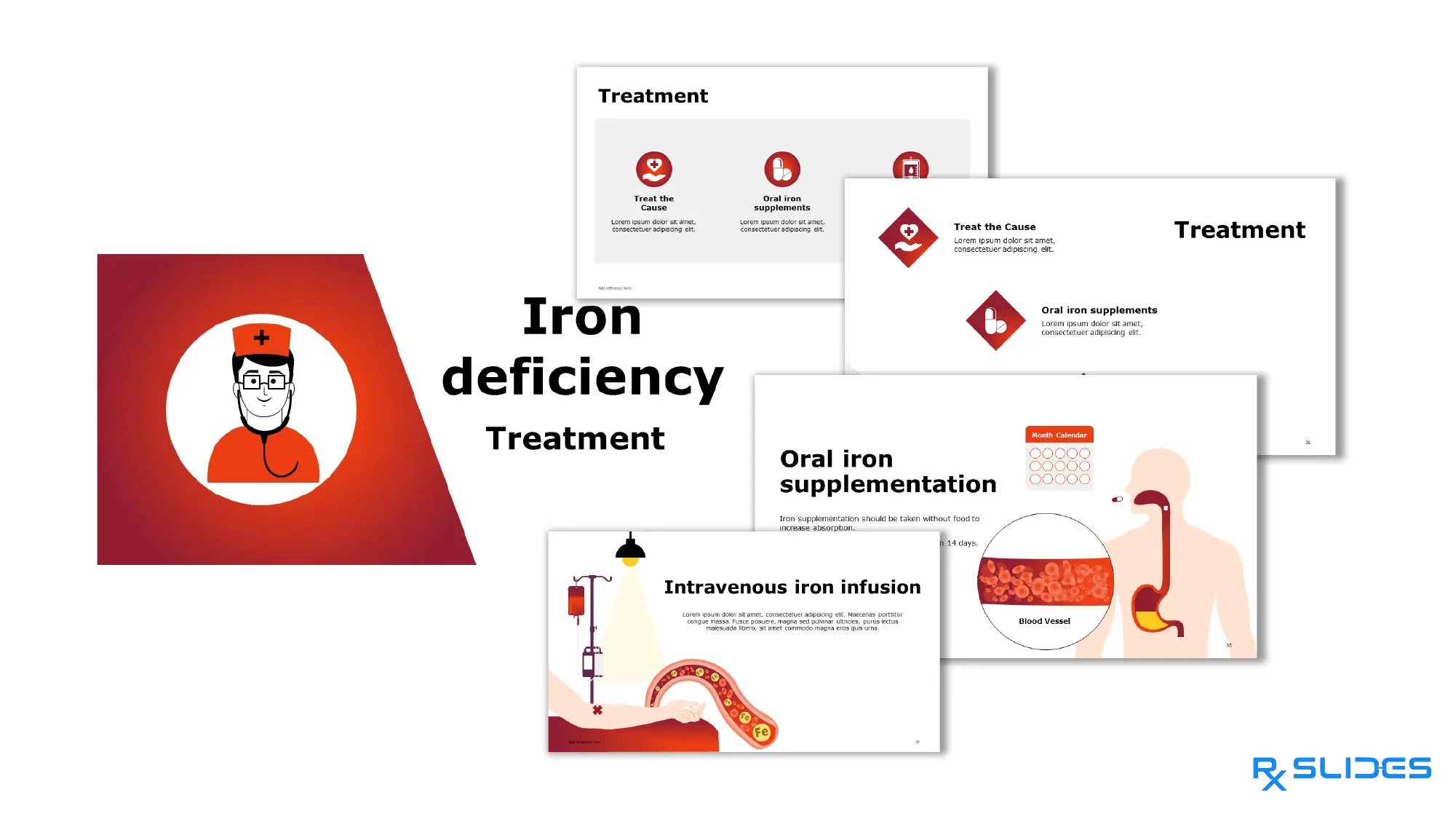 Download Iron Deficiency Anemia PowerPoint Template | RxSlides