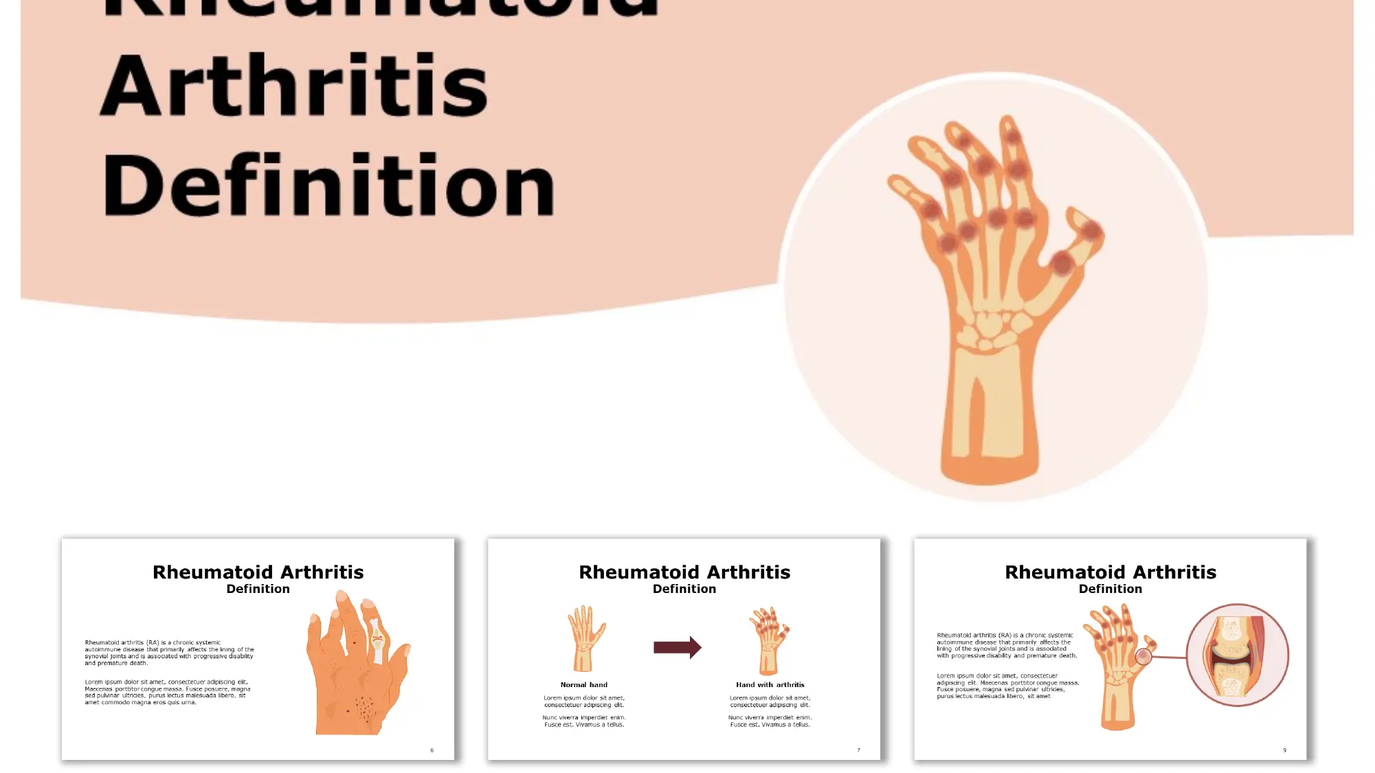 Download Rheumatoid Arthritis PowerPoint Template|RxSlides