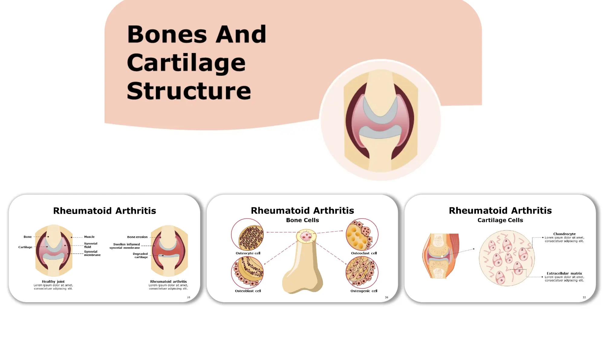 Download Rheumatoid Arthritis PowerPoint Template|RxSlides