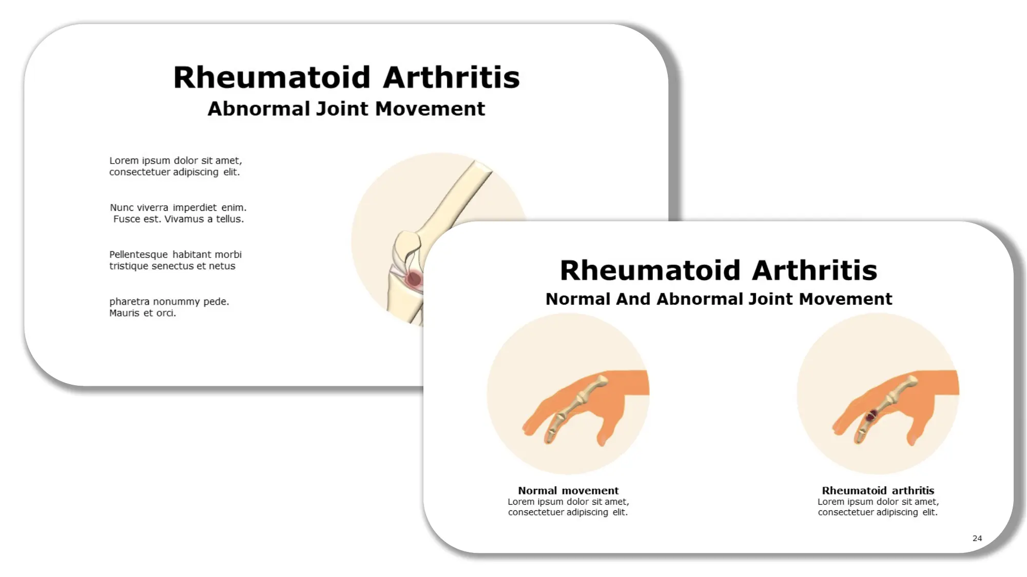 Download Rheumatoid Arthritis PowerPoint Template|RxSlides