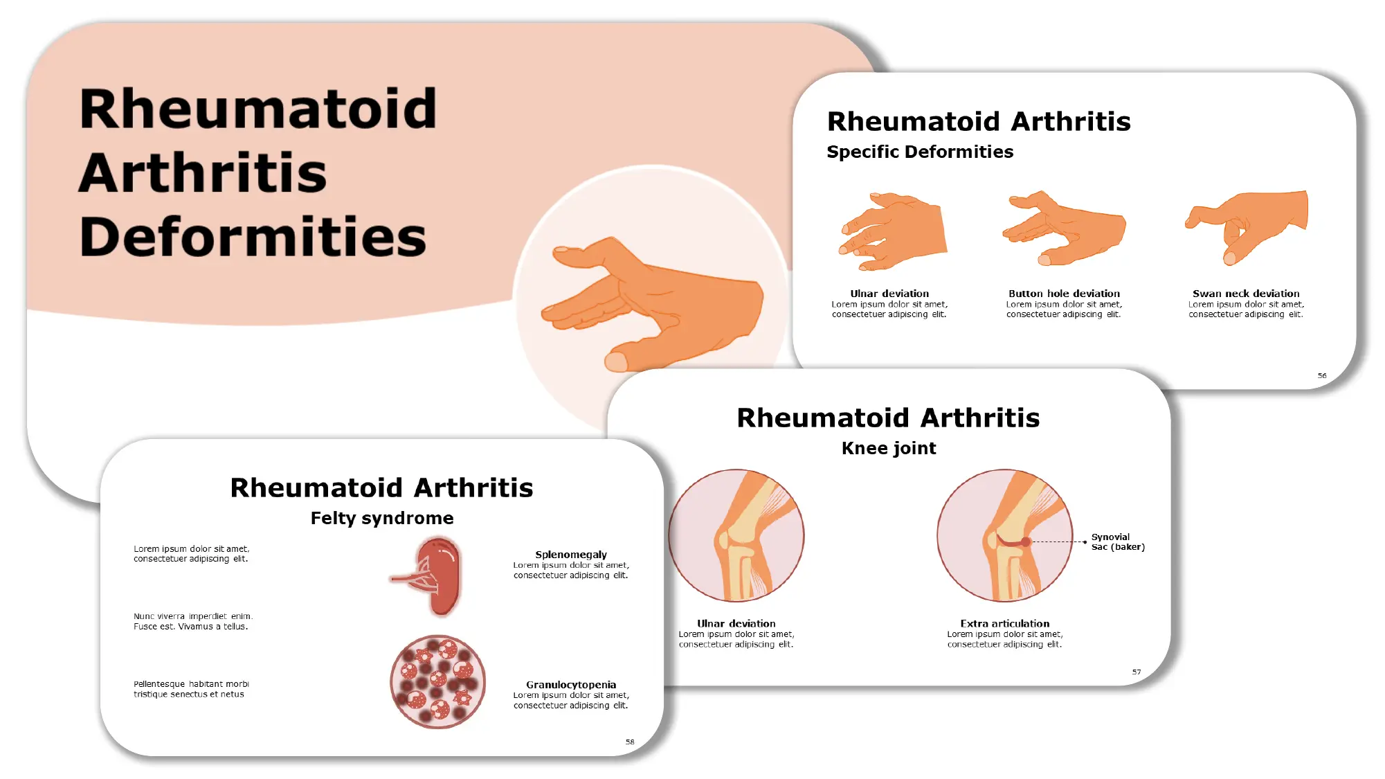 Download Rheumatoid Arthritis PowerPoint Template|RxSlides