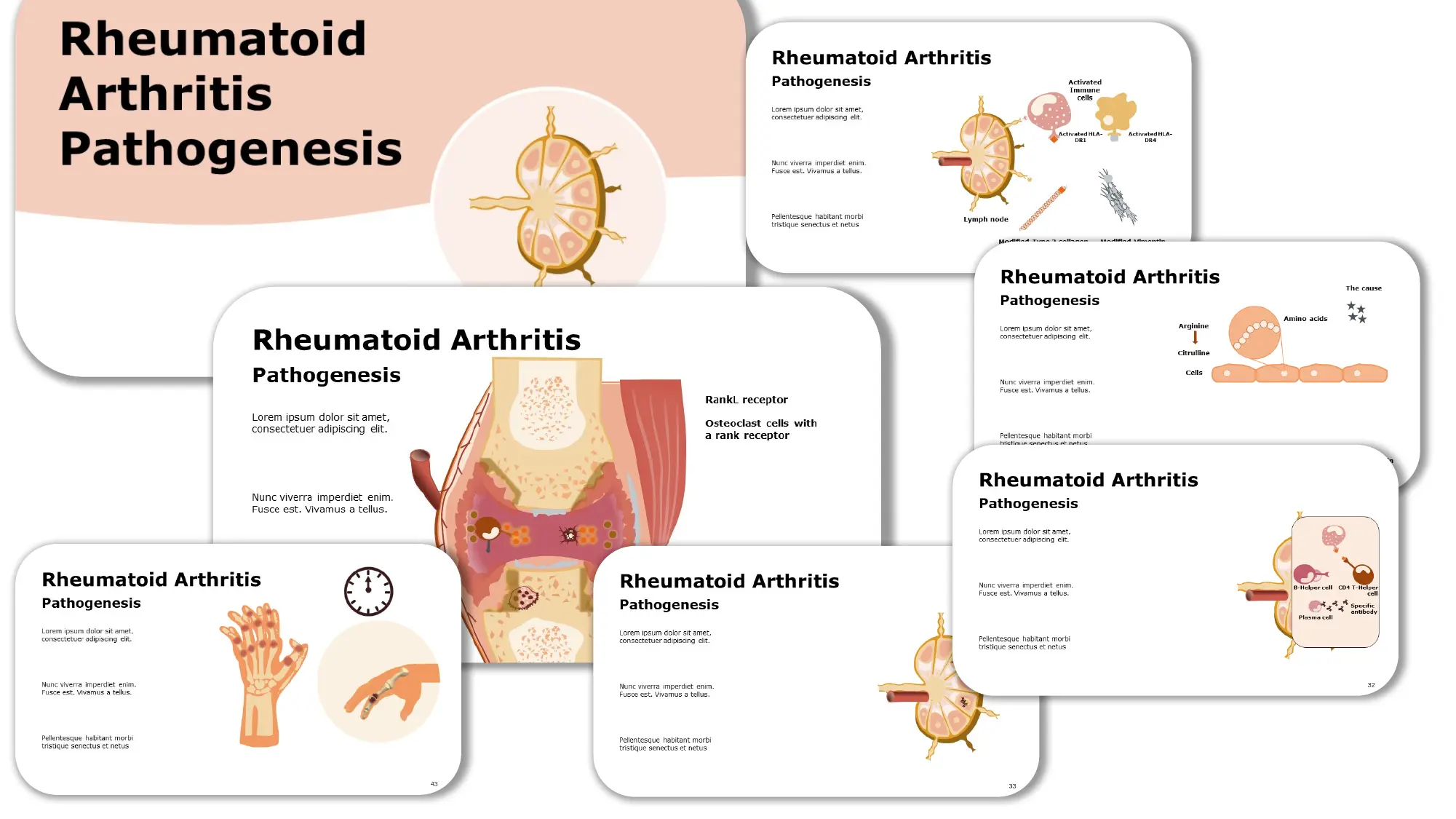 Download Rheumatoid Arthritis PowerPoint Template|RxSlides