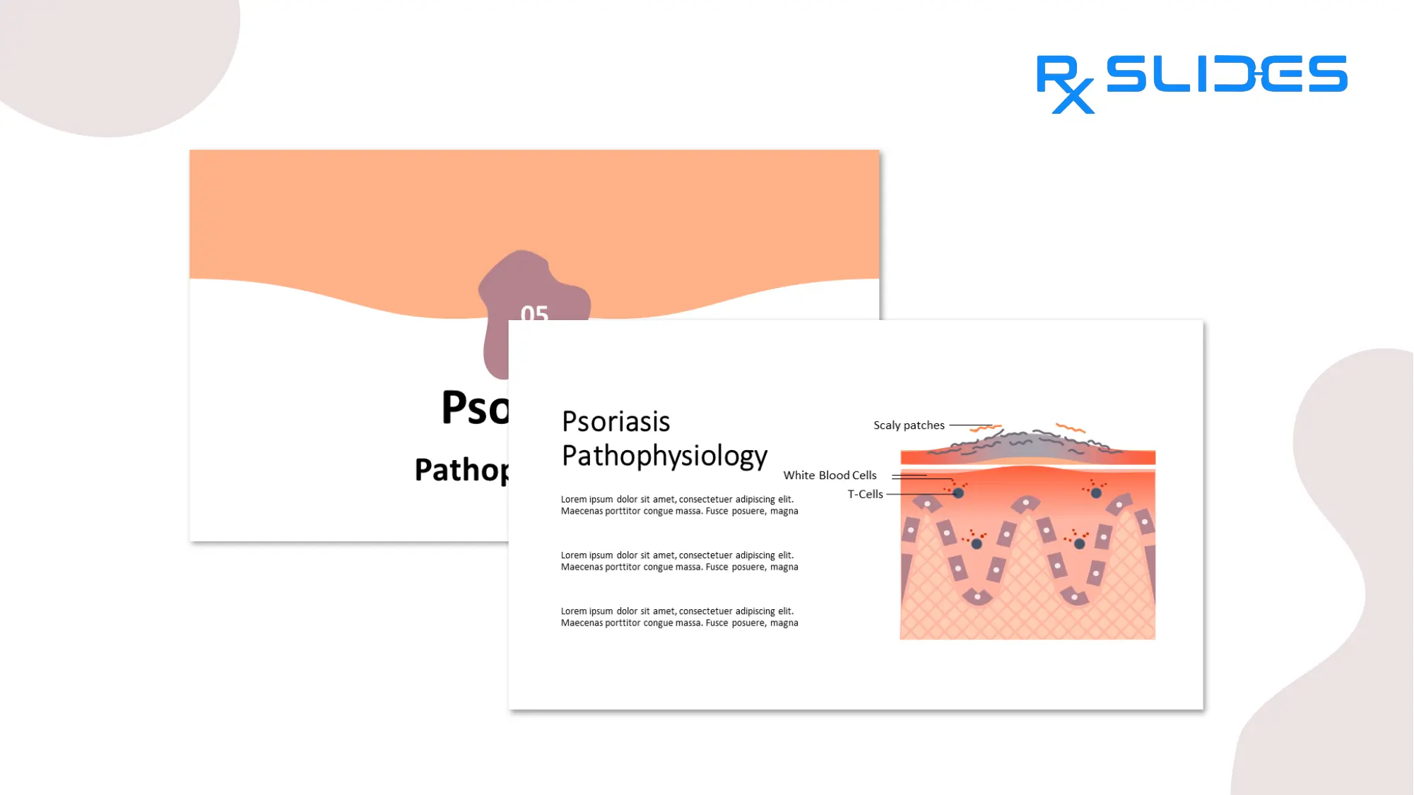 Download Psoriasis PowerPoint Template|
